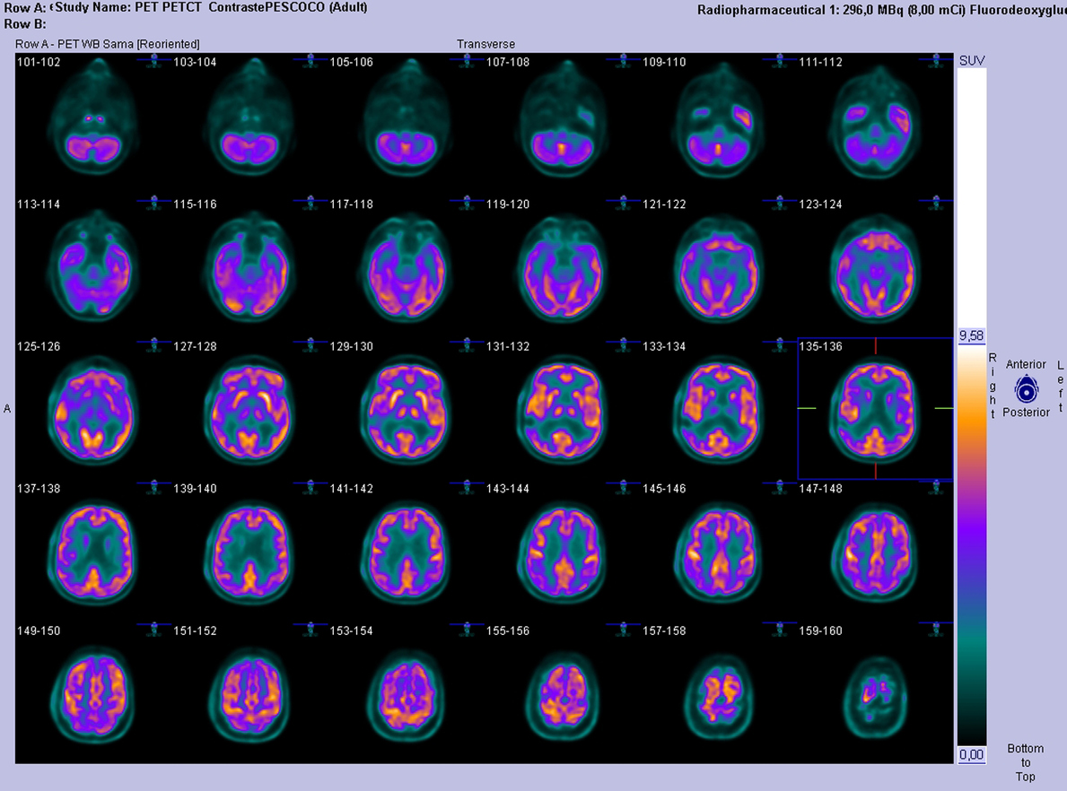 PHOTO GALLERY of brain imaging
