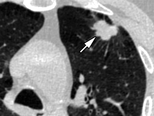 Trends and new technology in computed tomography systems