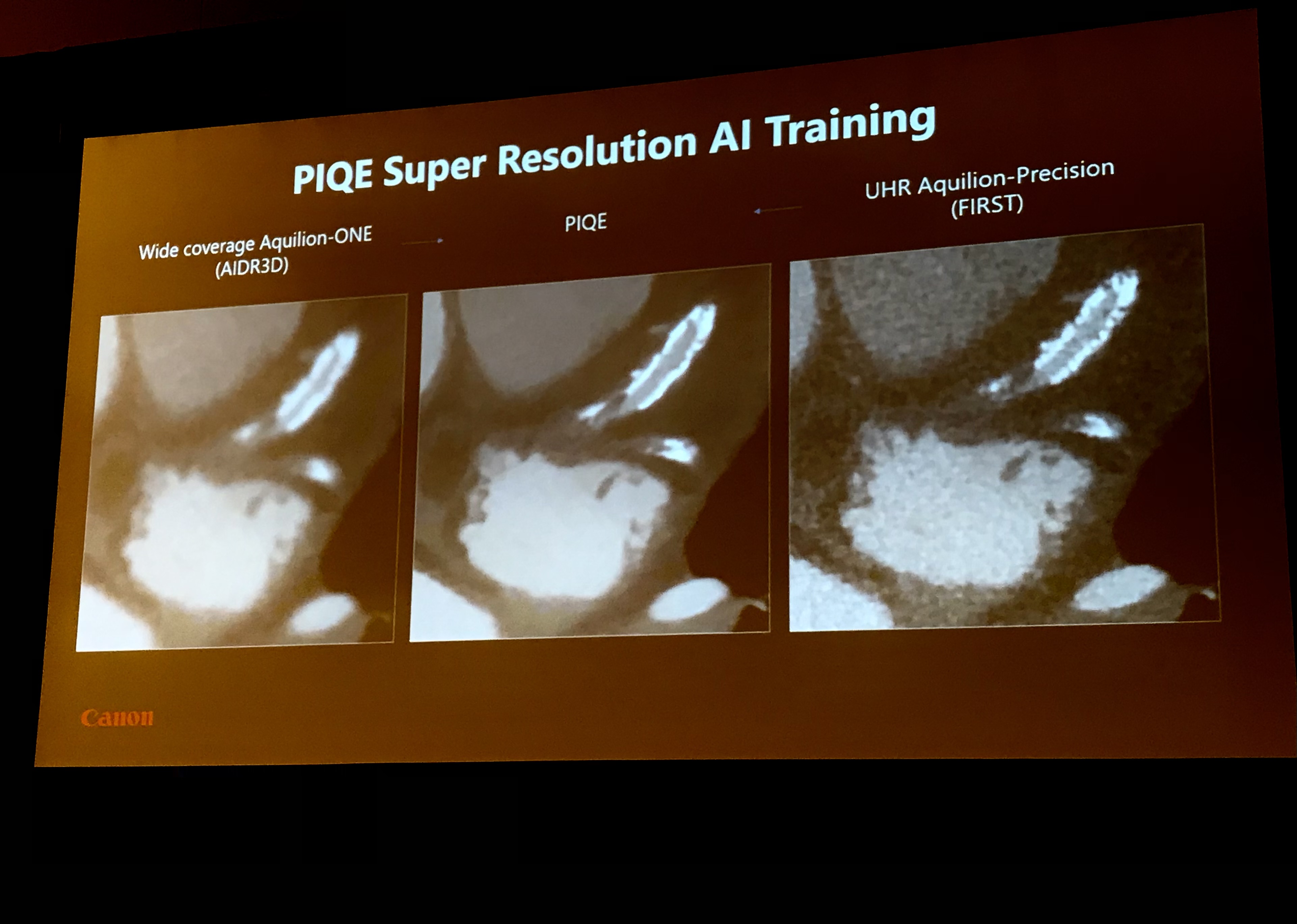 PHOTO GALLERY: Examples of FDA-cleared AI in radiology