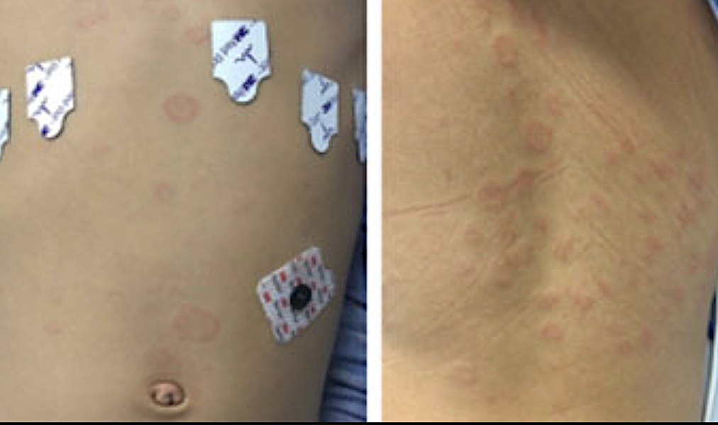 PHOTO GALLERY: What does COVID-19 look like on medical imaging?