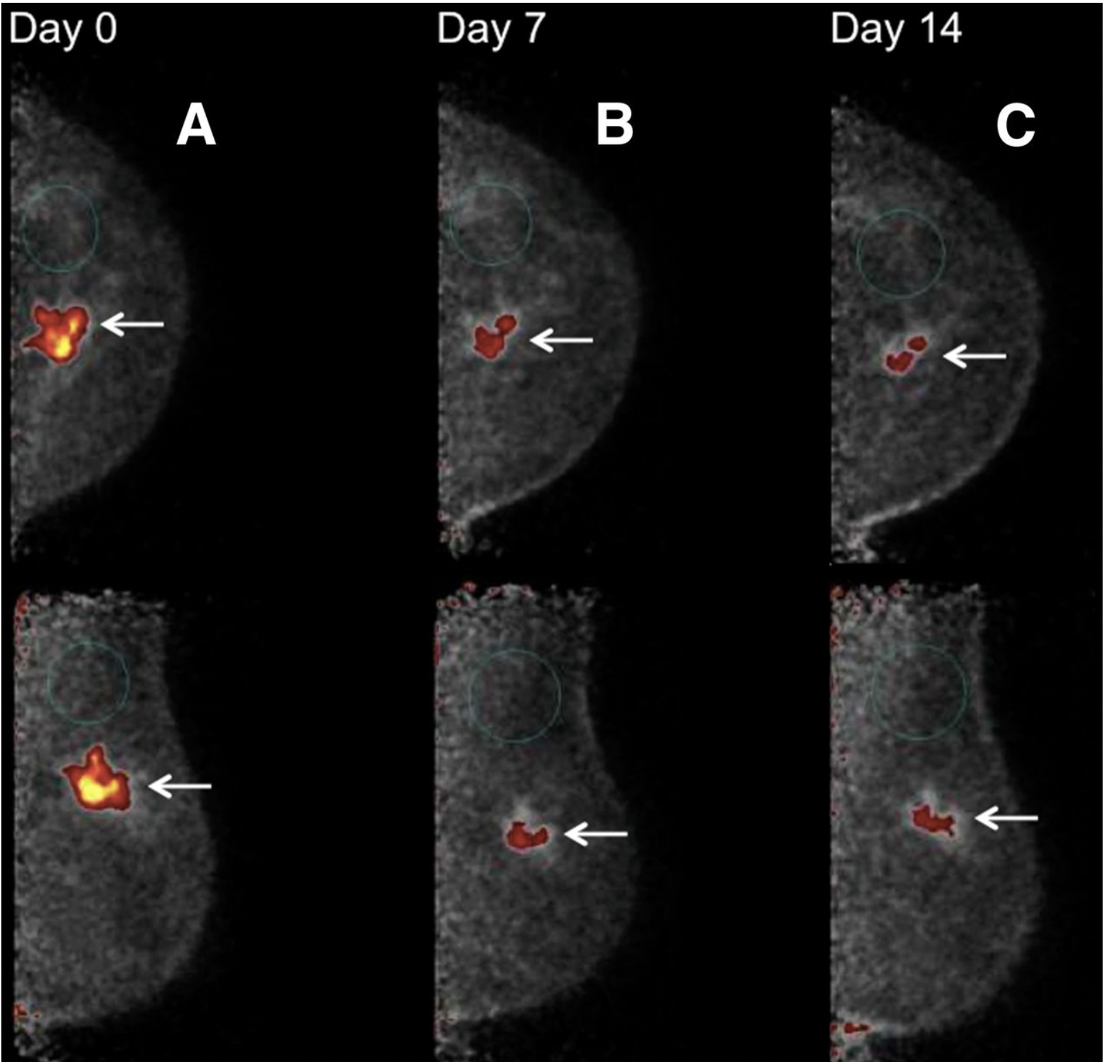 PHOTO GALLERY: What does breast cancer look like on mammography