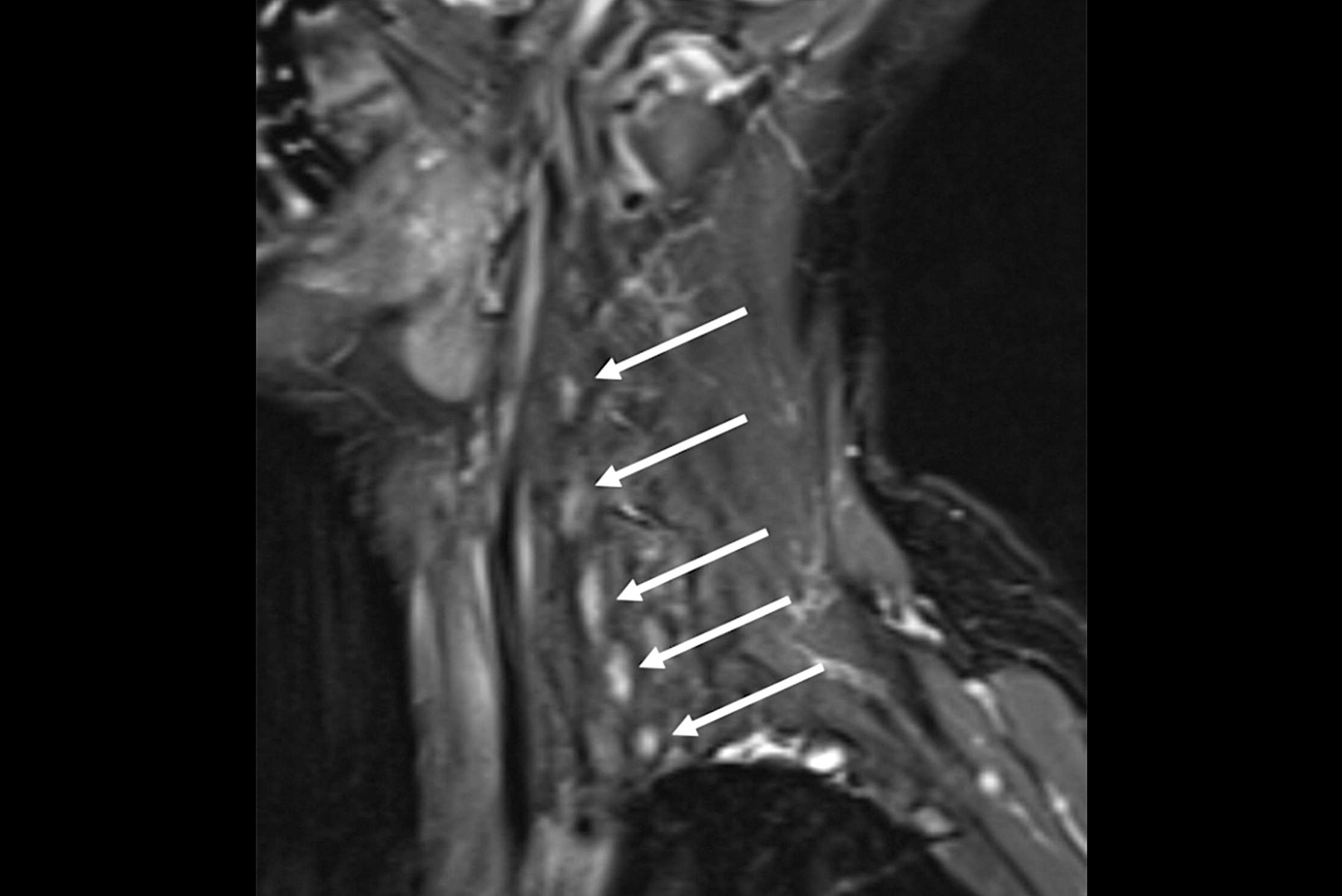 PHOTO GALLERY: What does COVID-19 look like on medical imaging?
