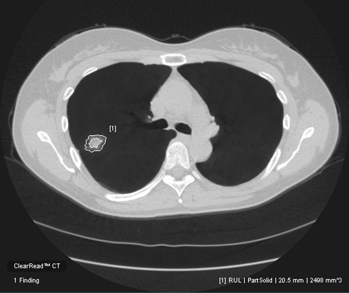 PHOTO GALLERY: Examples of FDA-cleared AI in radiology