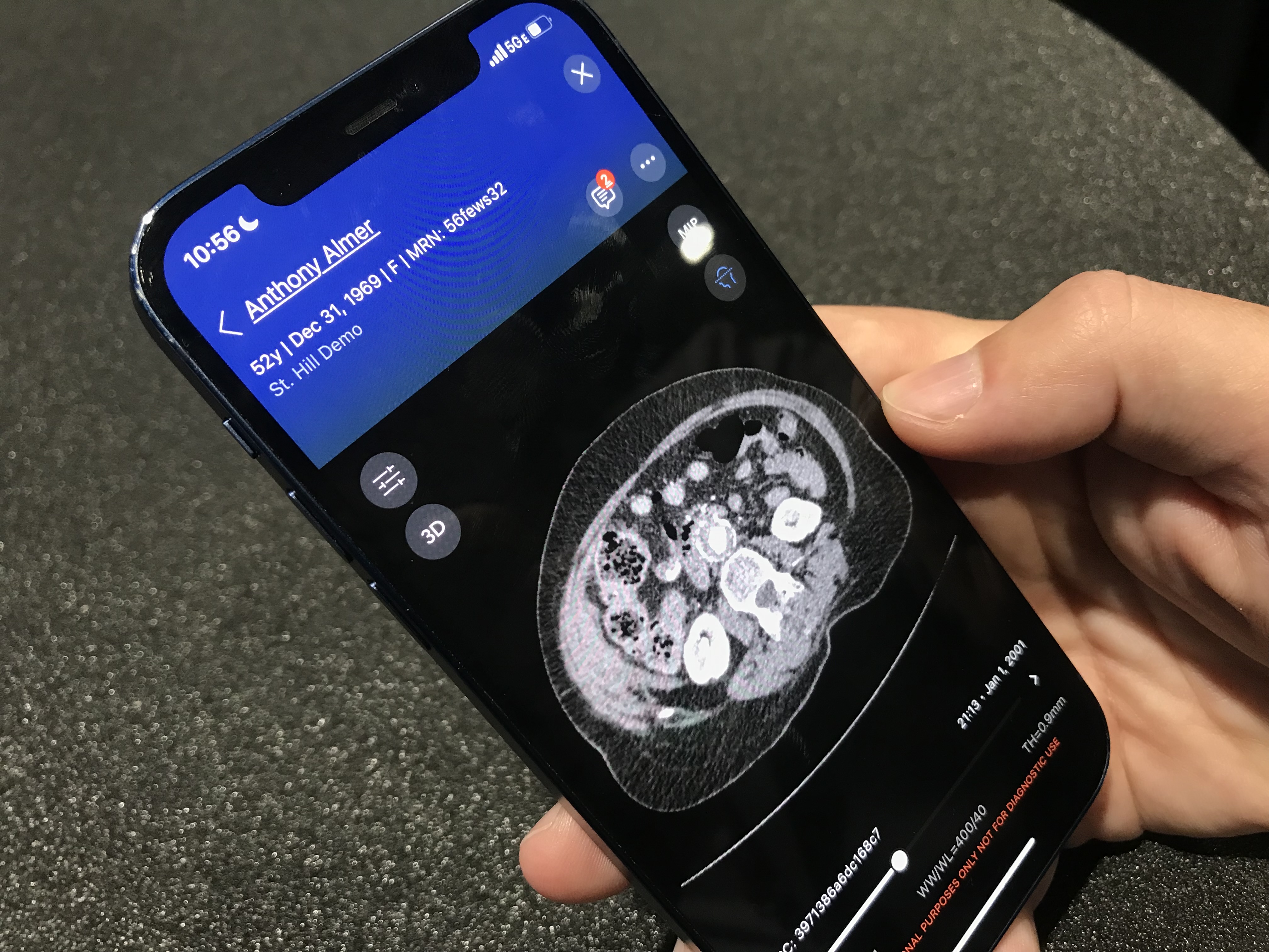 PHOTO GALLERY: Examples of FDA-cleared AI in radiology