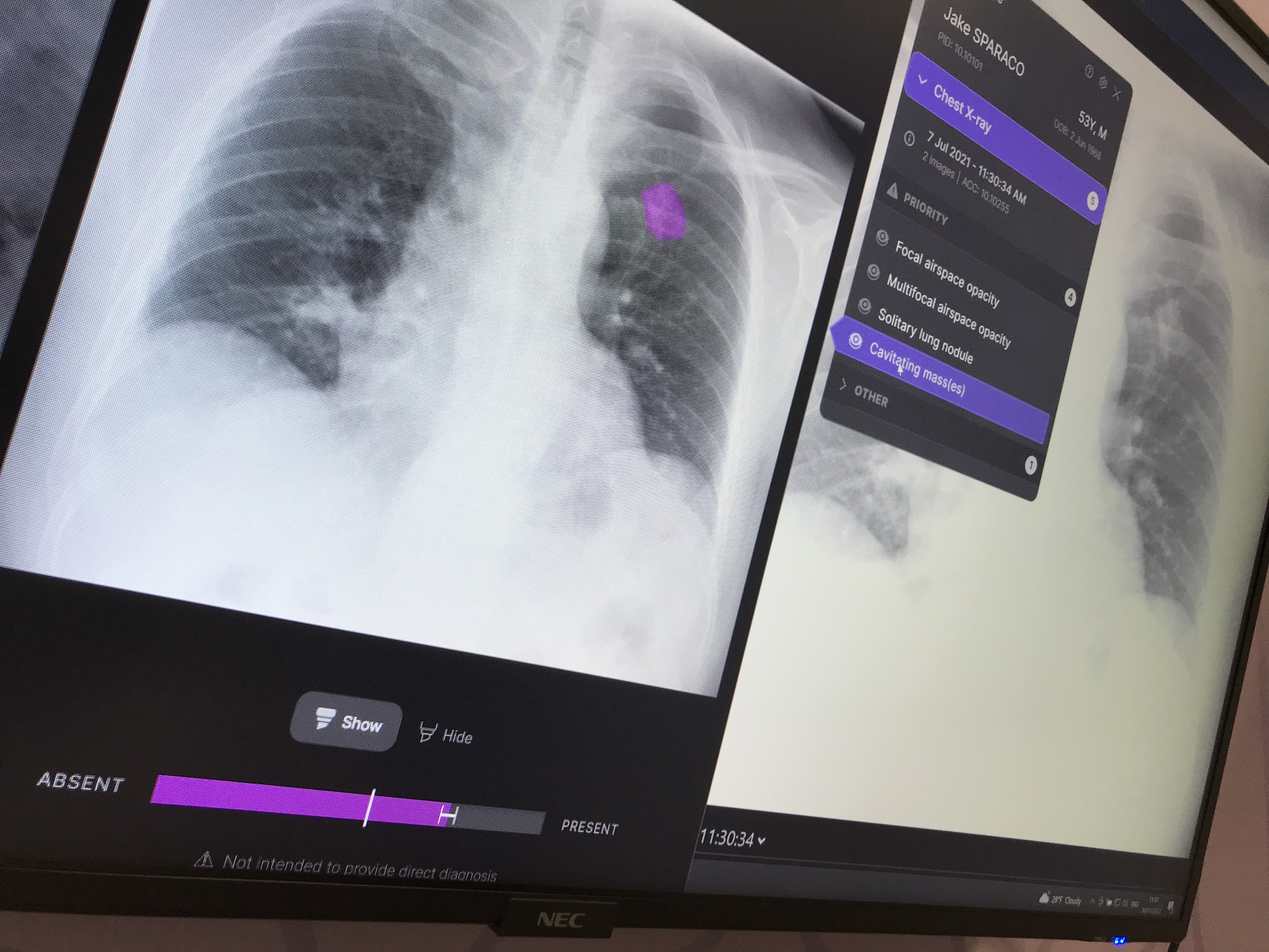 PHOTO GALLERY: Examples of FDA-cleared AI in radiology