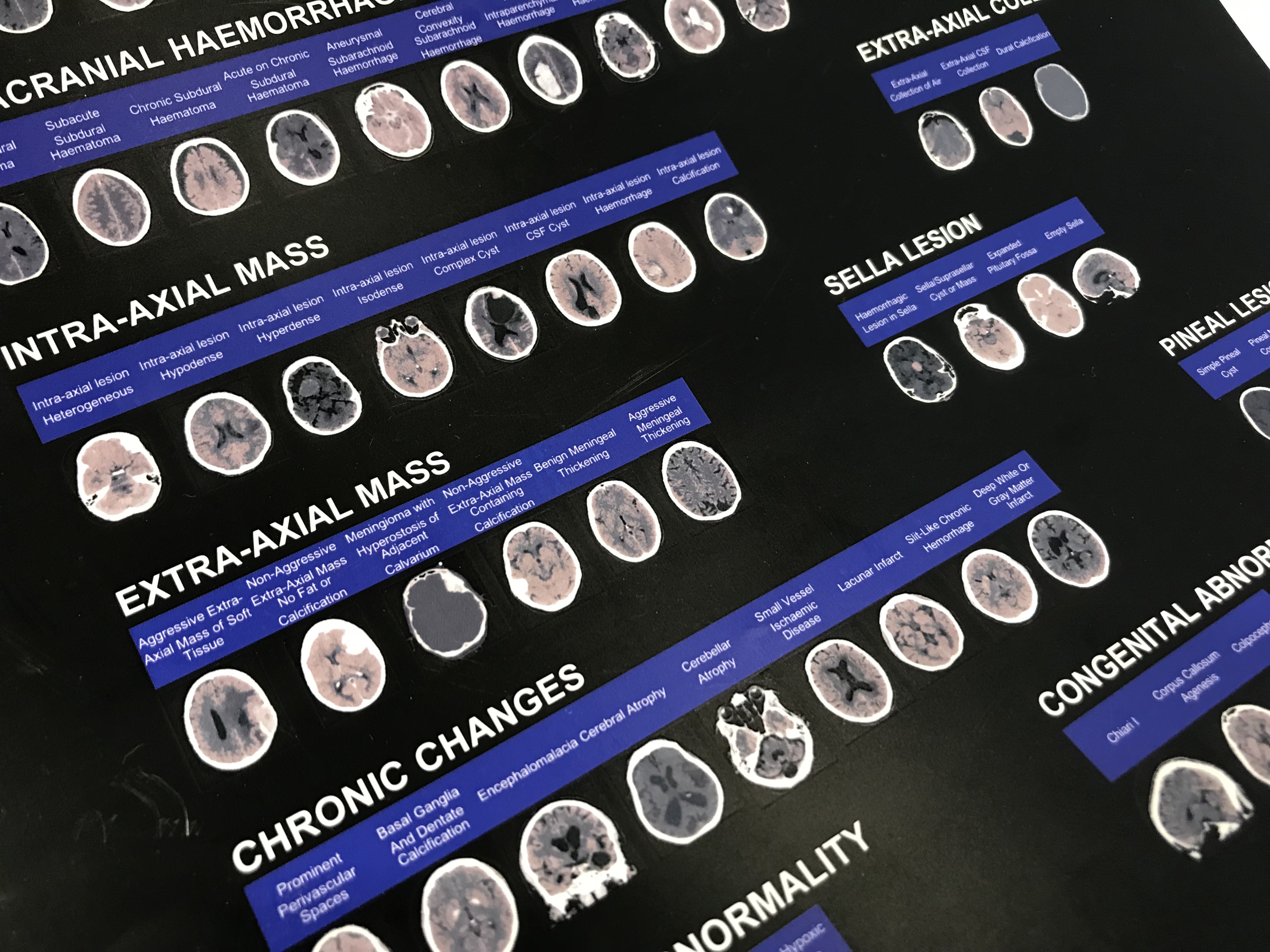 PHOTO GALLERY of brain imaging