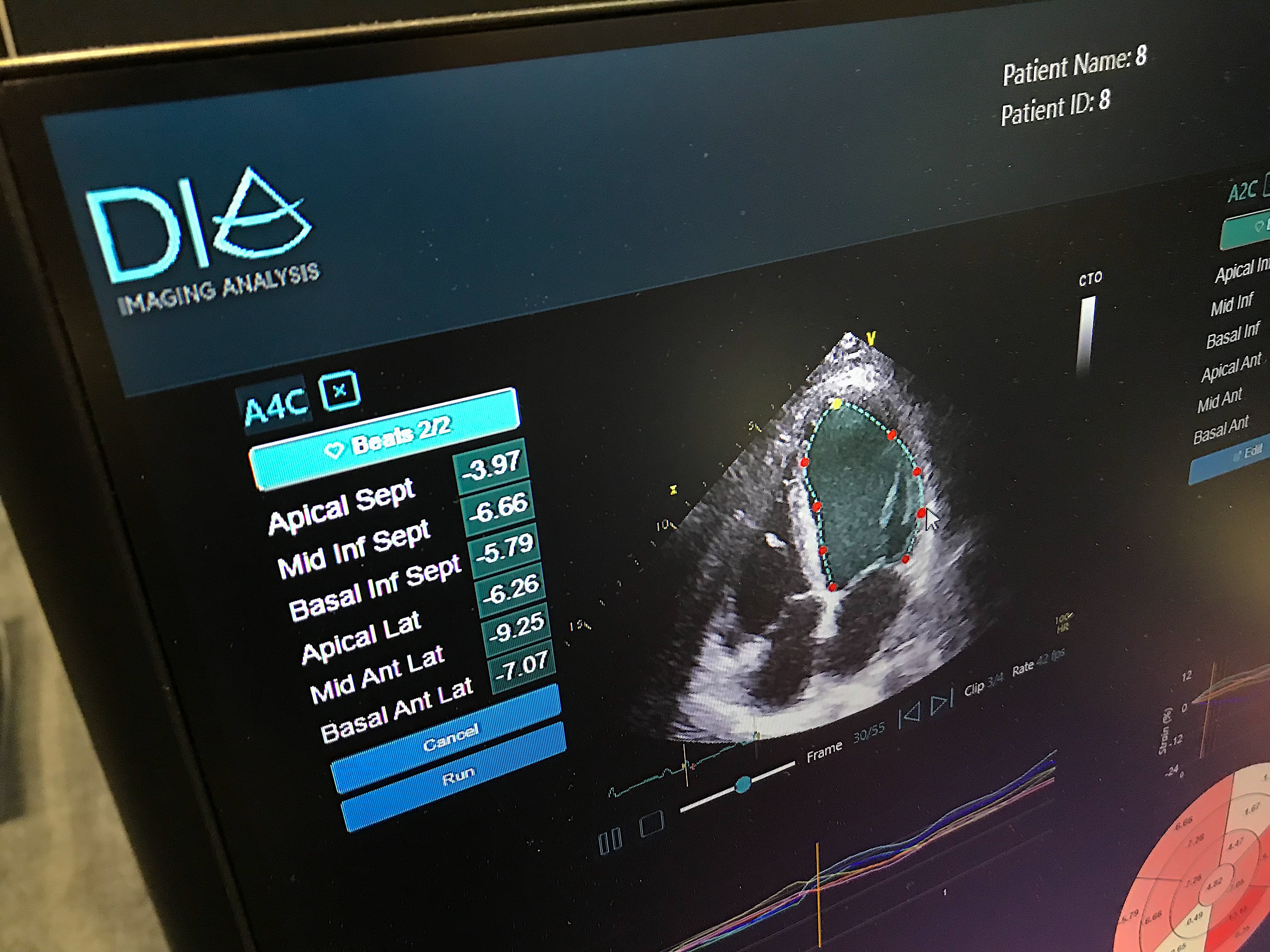 PHOTO GALLERY: Examples of FDA-cleared AI in radiology