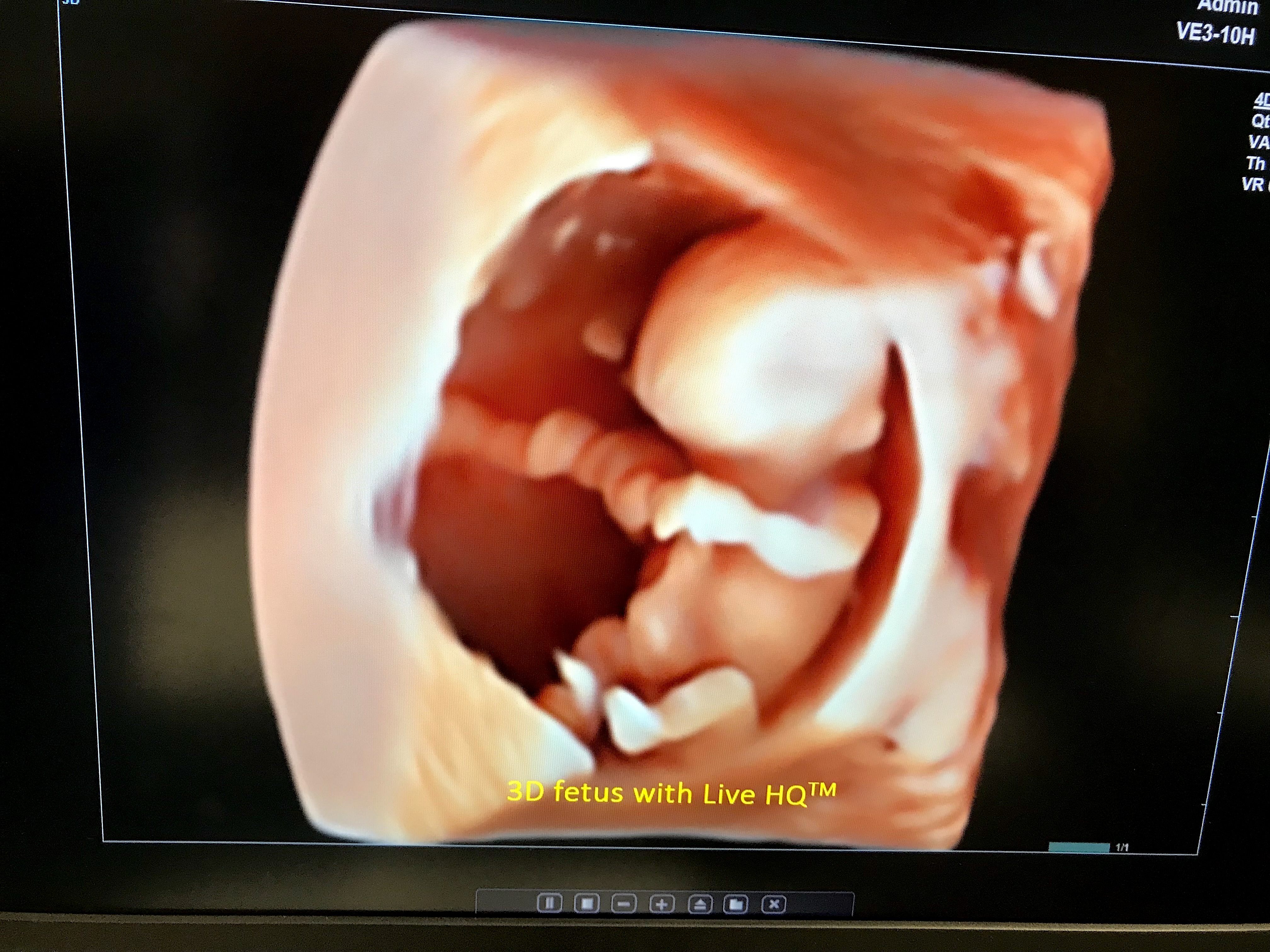 PHOTO GALLERY: What does fetal medical imaging look like?