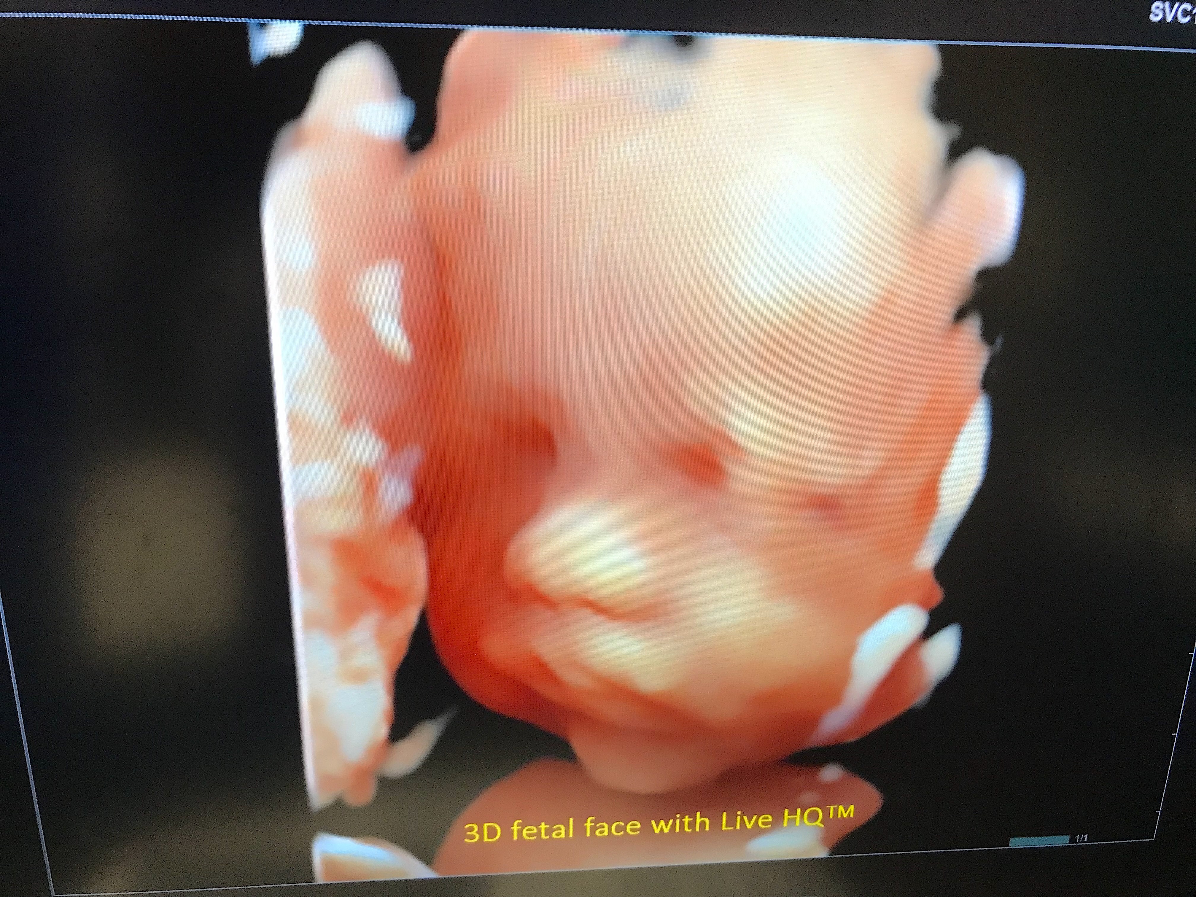 PHOTO GALLERY: What does fetal medical imaging look like?