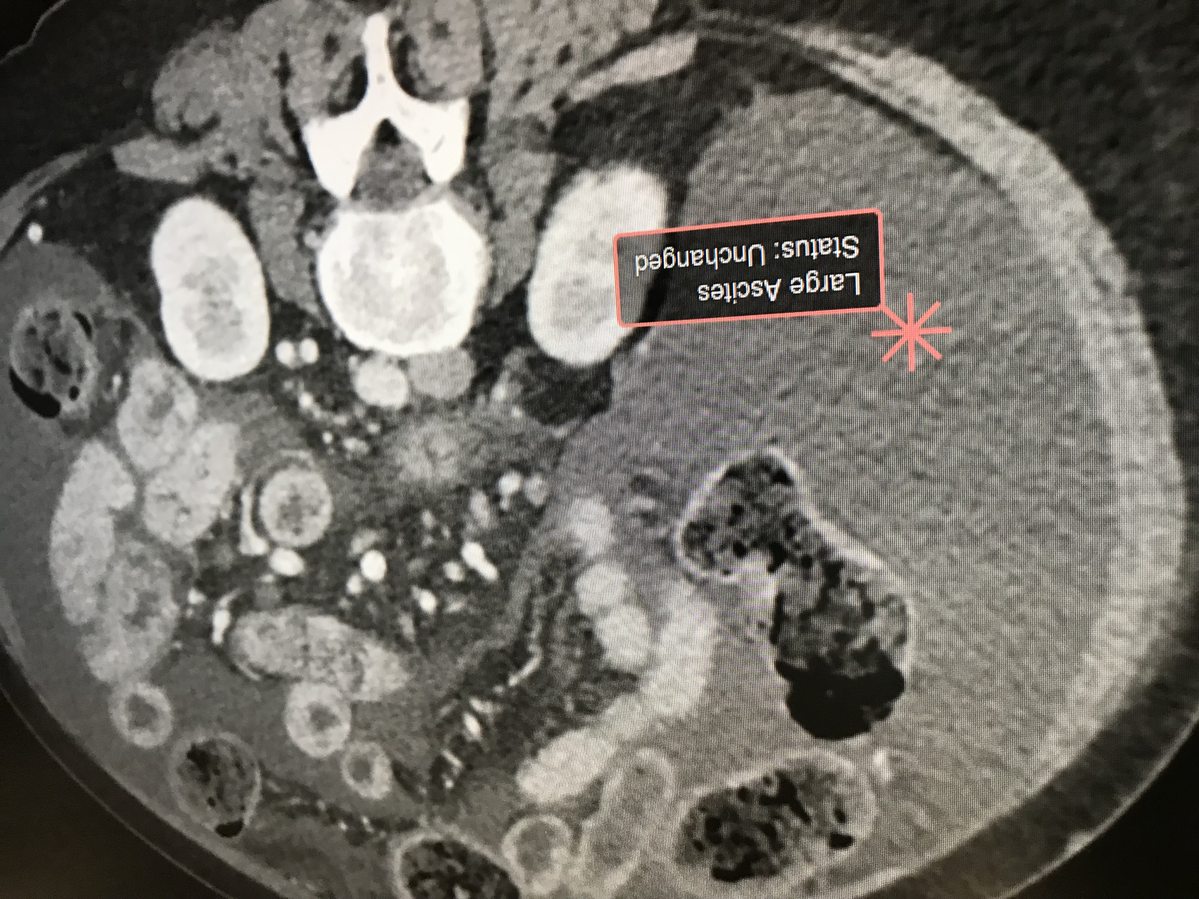 PHOTO GALLERY: Examples of FDA-cleared AI in radiology