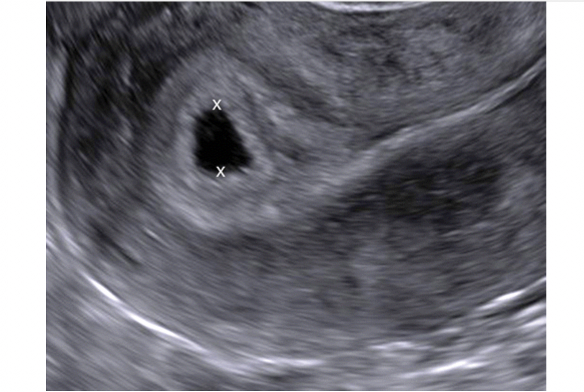 PHOTO GALLERY: What does fetal medical imaging look like?