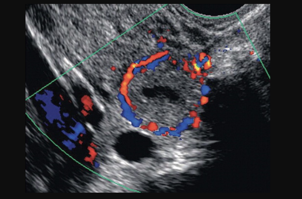 PHOTO GALLERY: What does fetal medical imaging look like?