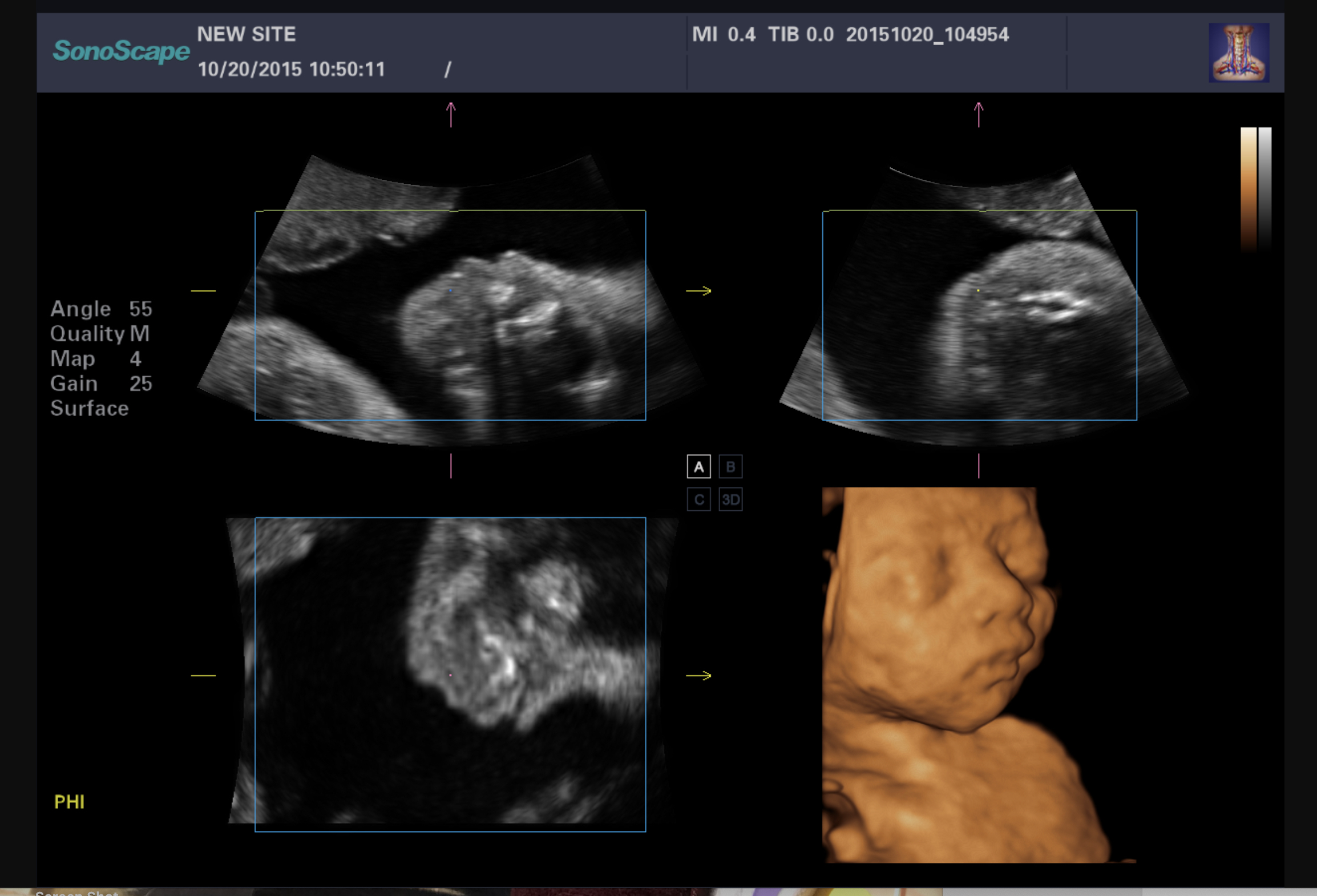 PHOTO GALLERY: What does fetal medical imaging look like?