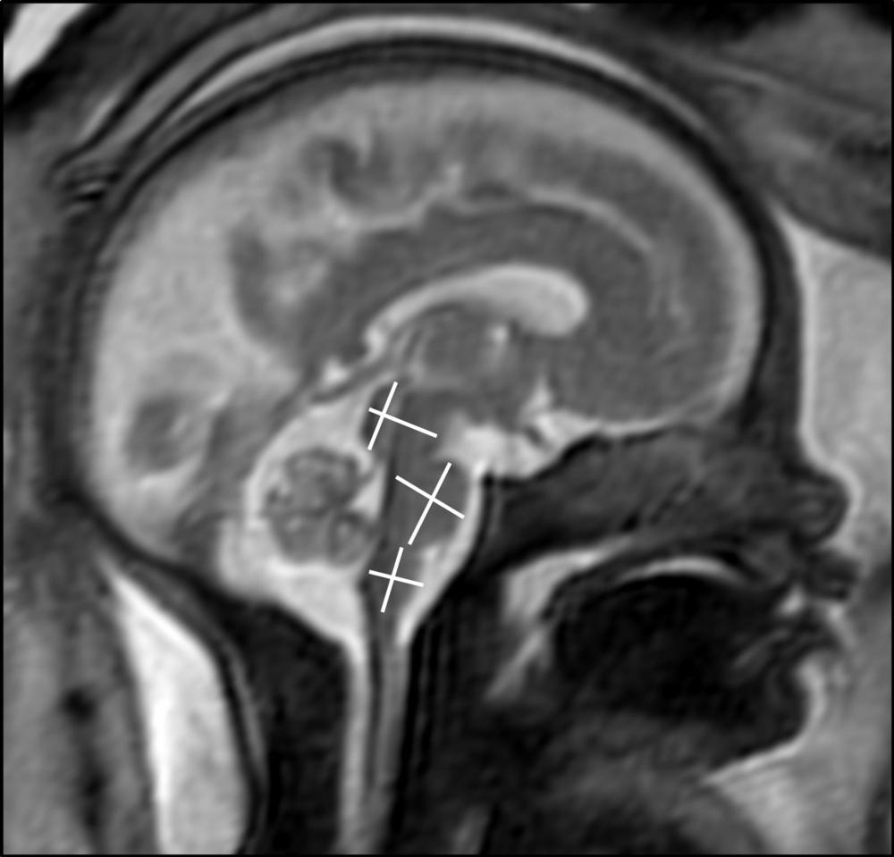 PHOTO GALLERY of brain imaging