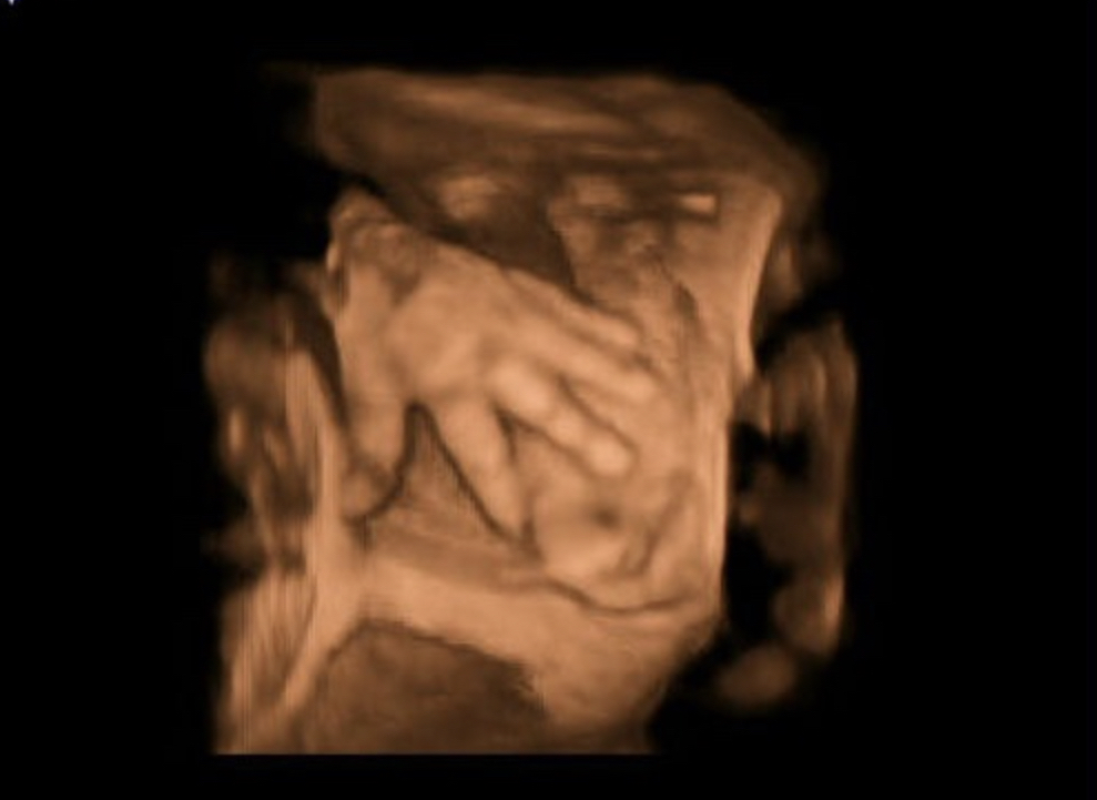 PHOTO GALLERY: What does fetal medical imaging look like?
