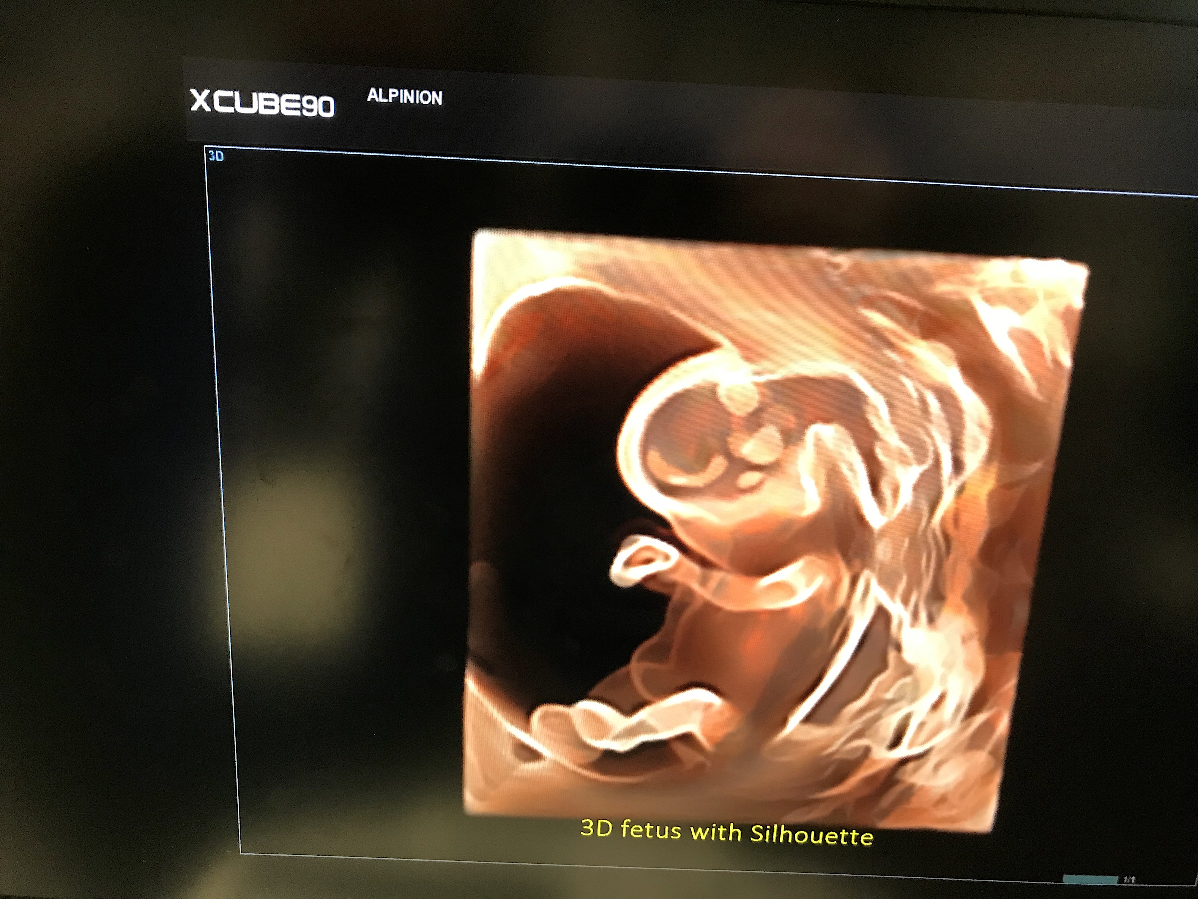 PHOTO GALLERY: What does fetal medical imaging look like?