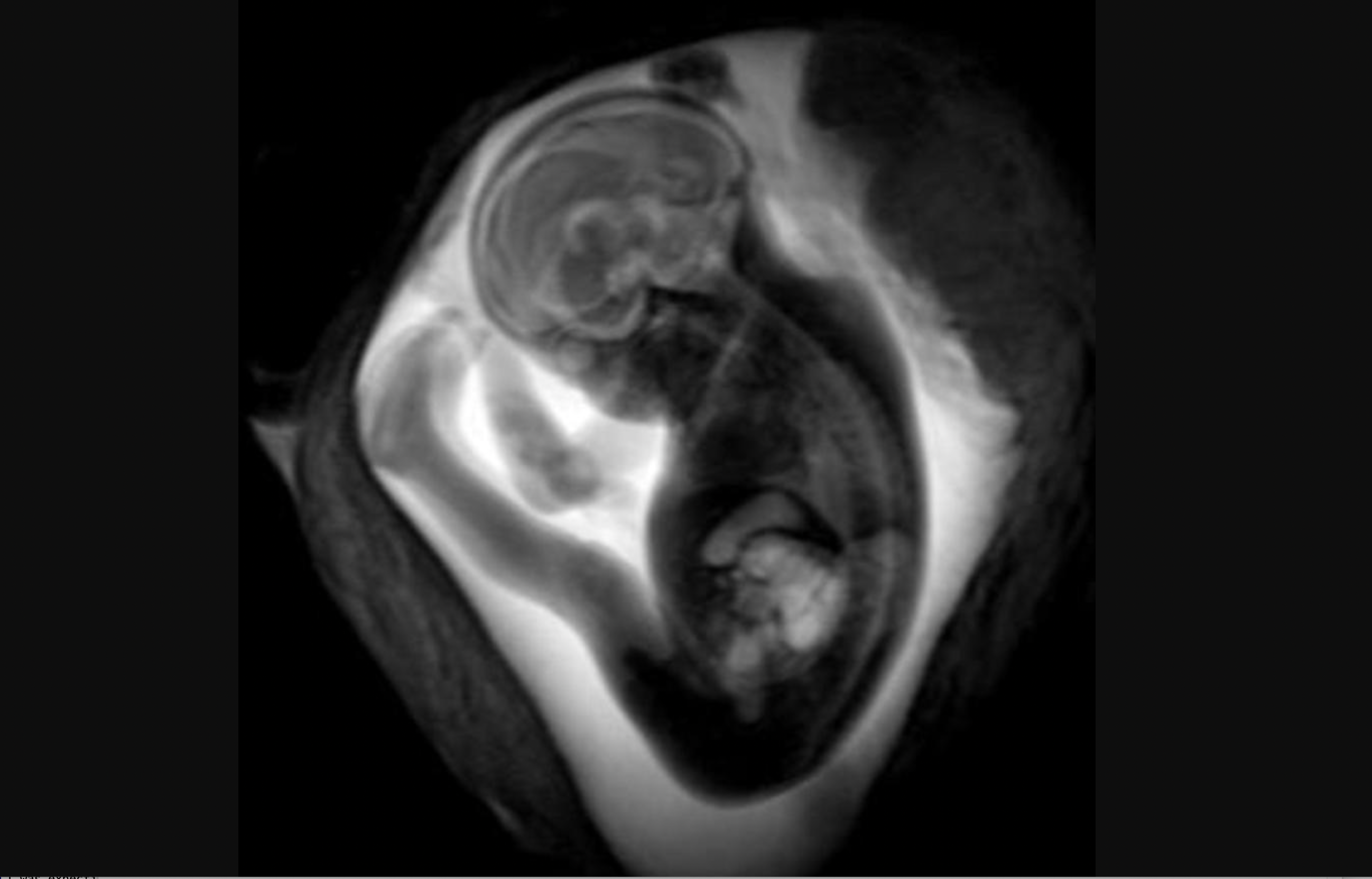 PHOTO GALLERY: What does fetal medical imaging look like?