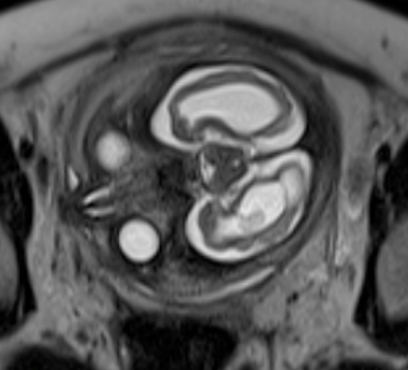 PHOTO GALLERY: What does fetal medical imaging look like?