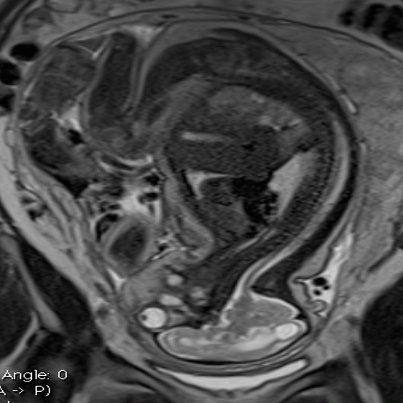 PHOTO GALLERY: What does fetal medical imaging look like?
