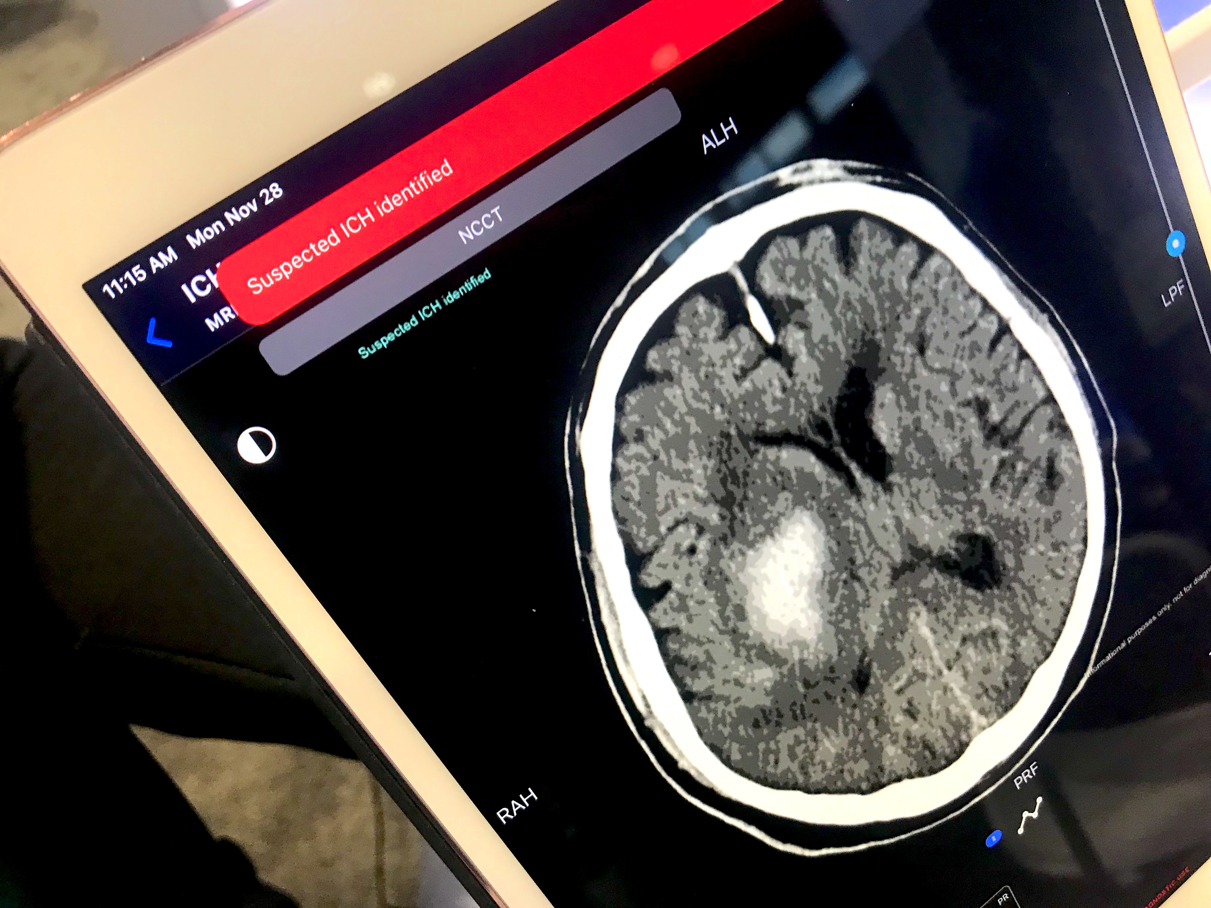 PHOTO GALLERY: Examples of FDA-cleared AI in radiology