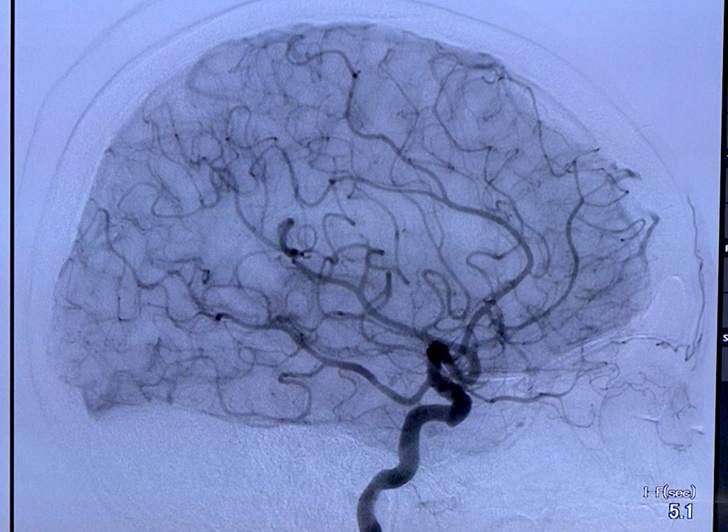 PHOTO GALLERY of brain imaging