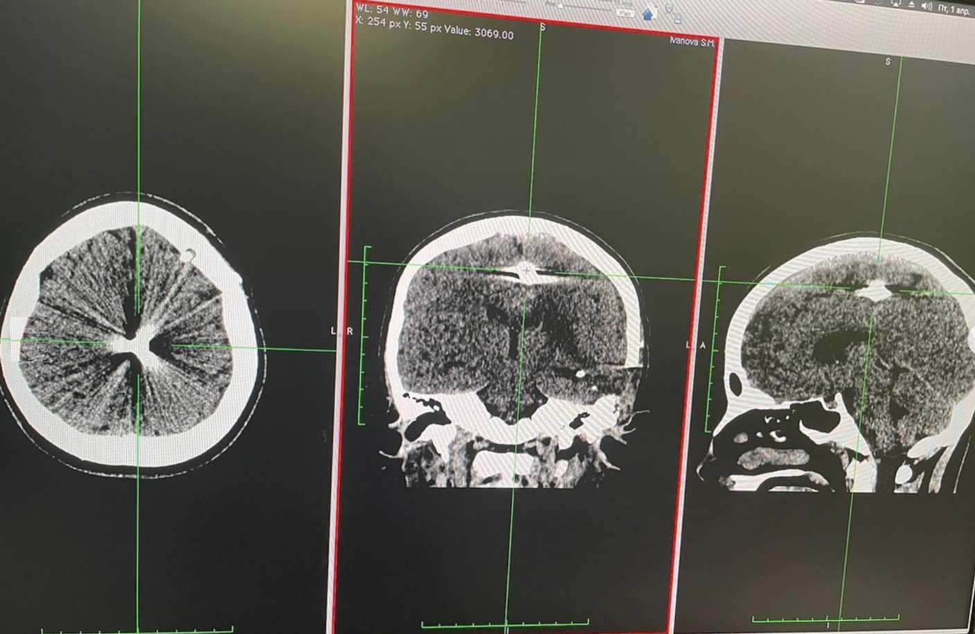 PHOTO GALLERY of brain imaging