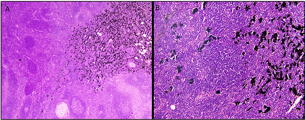 Imaging considerations included in tattoo guidelines for at-risk cancer ...