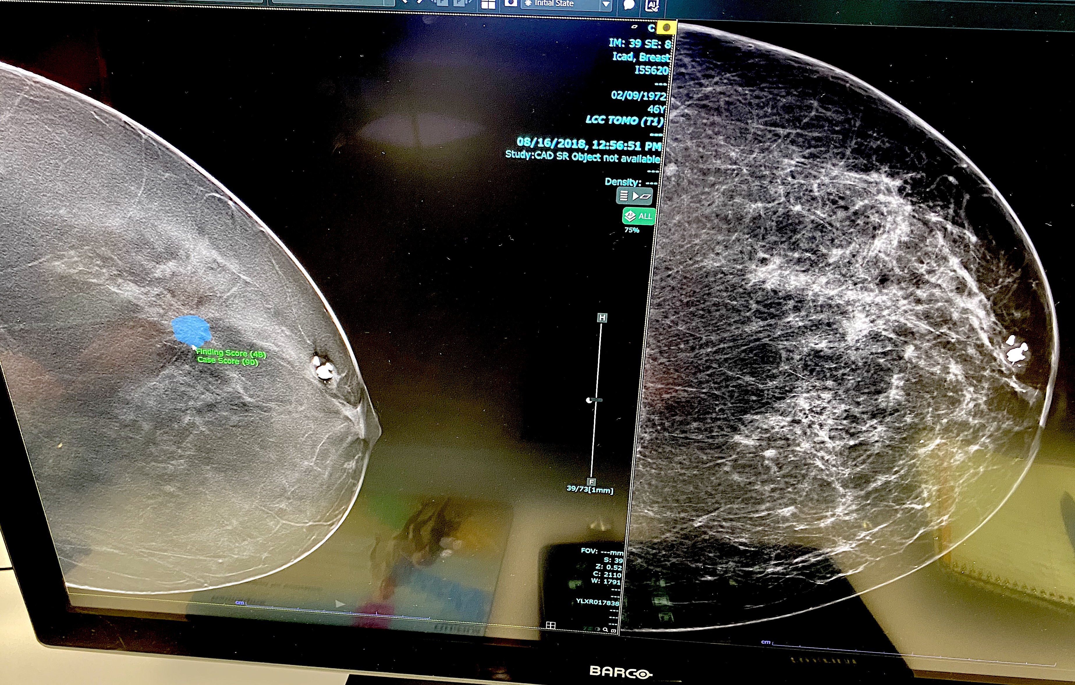 PHOTO GALLERY: Examples of FDA-cleared AI in radiology