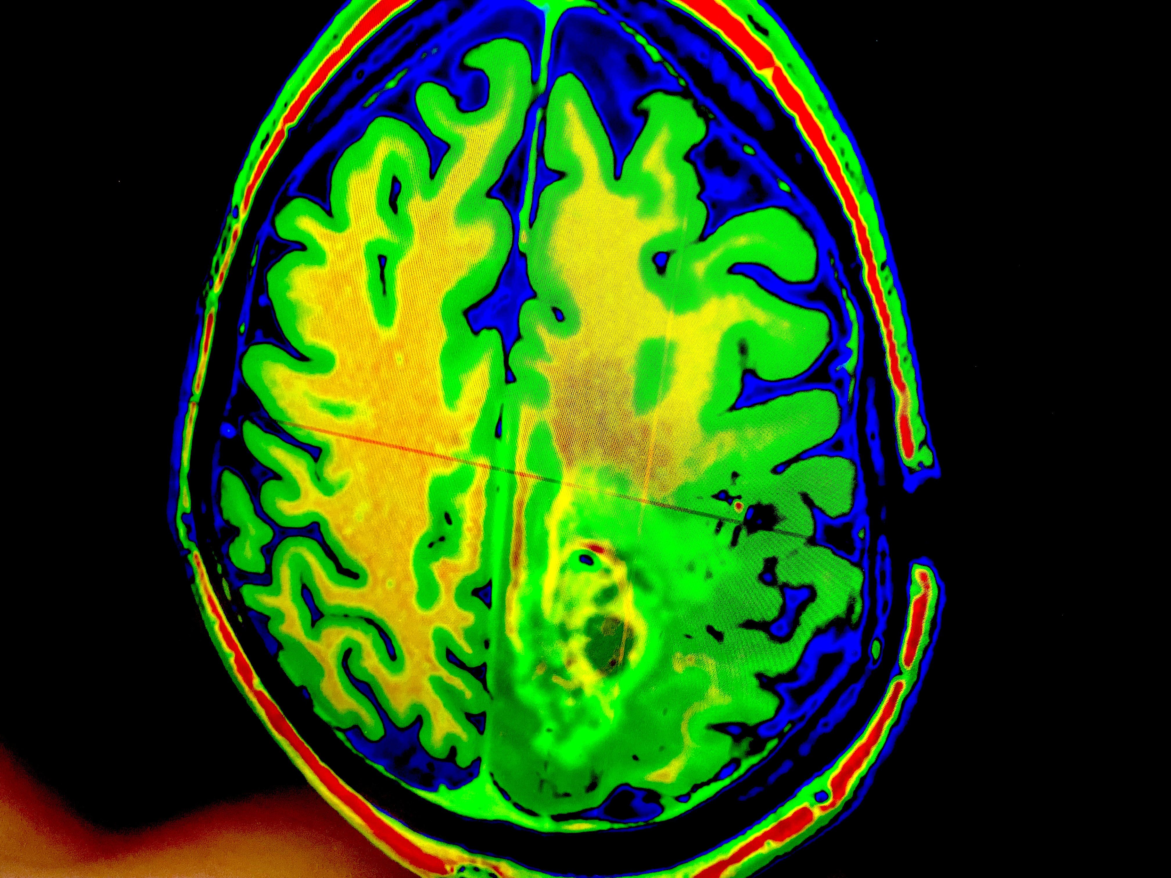 PHOTO GALLERY of brain imaging