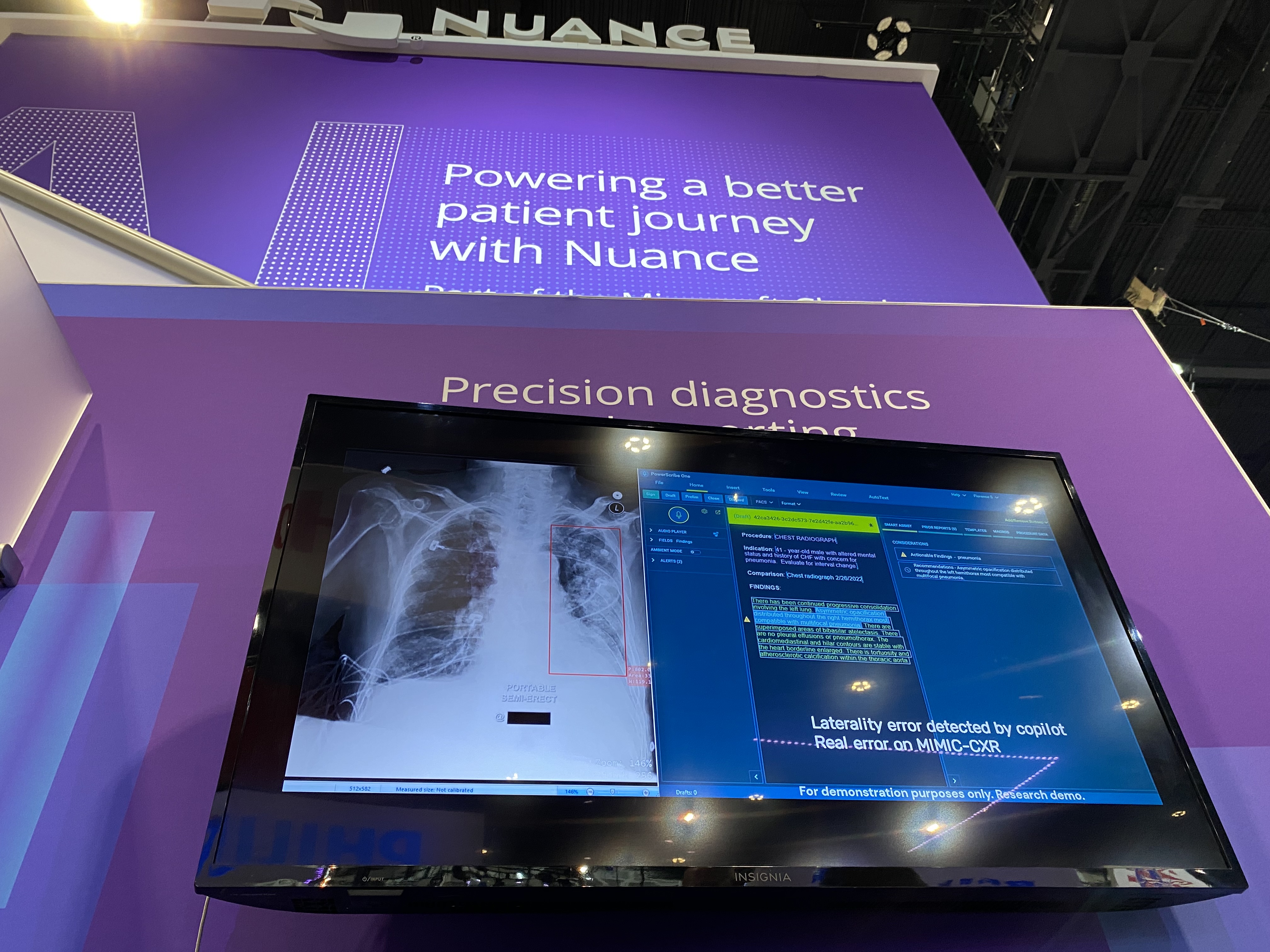 PHOTO GALLERY: Examples of FDA-cleared AI in radiology