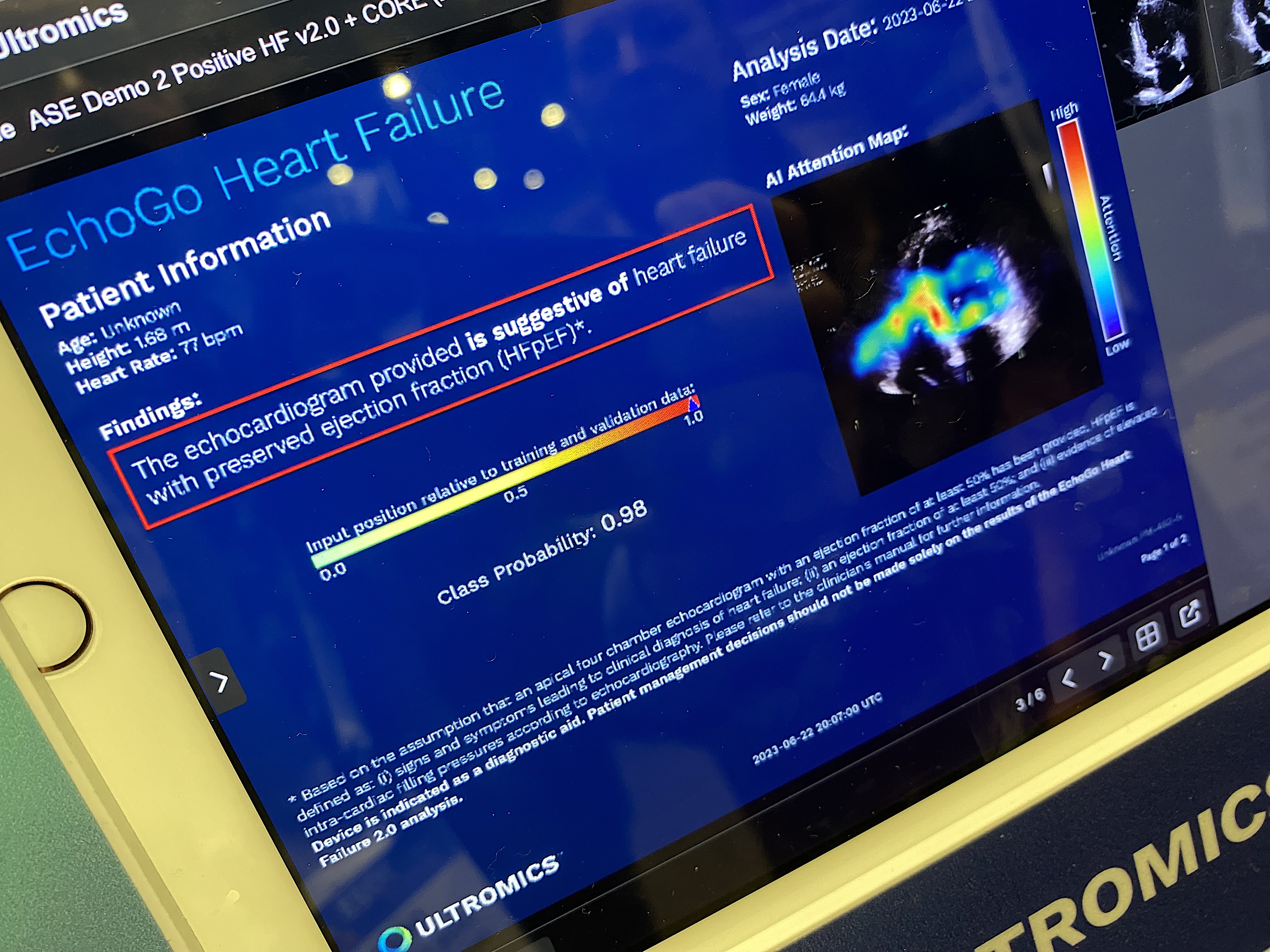 PHOTO GALLERY: Examples of FDA-cleared AI in radiology