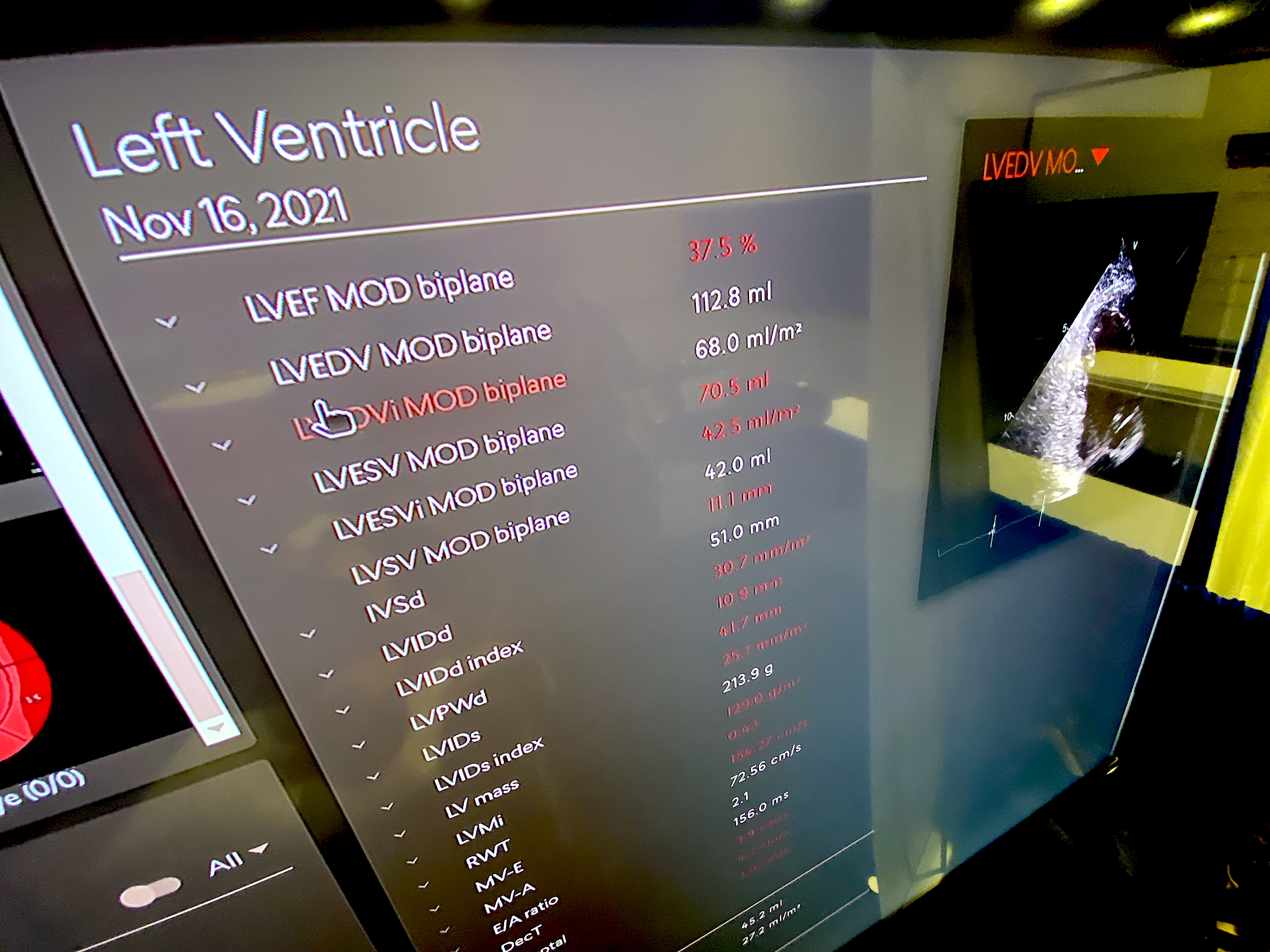 PHOTO GALLERY: Examples of FDA-cleared AI in radiology