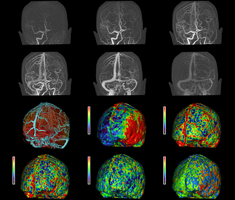 PHOTO GALLERY of brain imaging