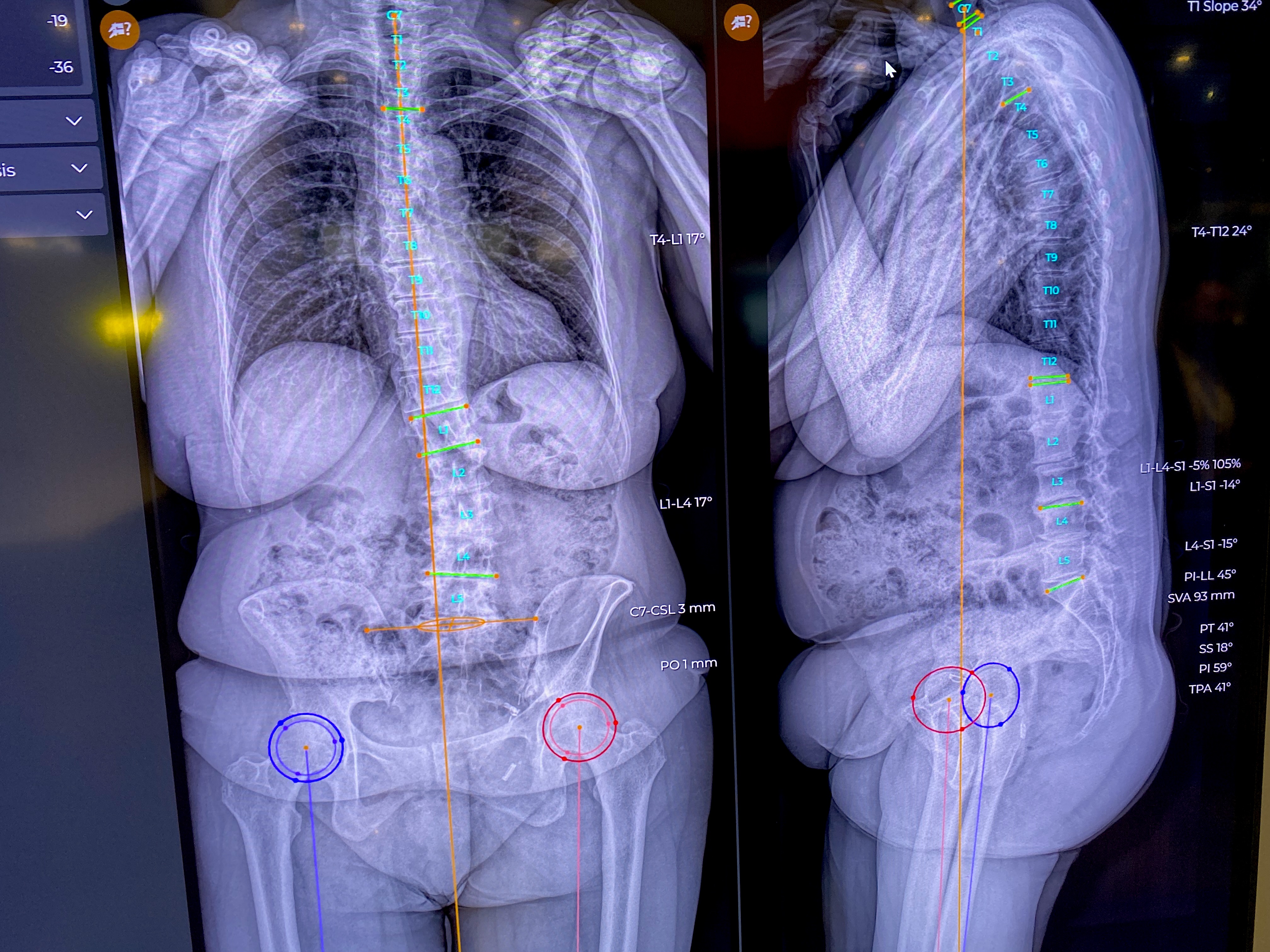 PHOTO GALLERY: Examples of FDA-cleared AI in radiology