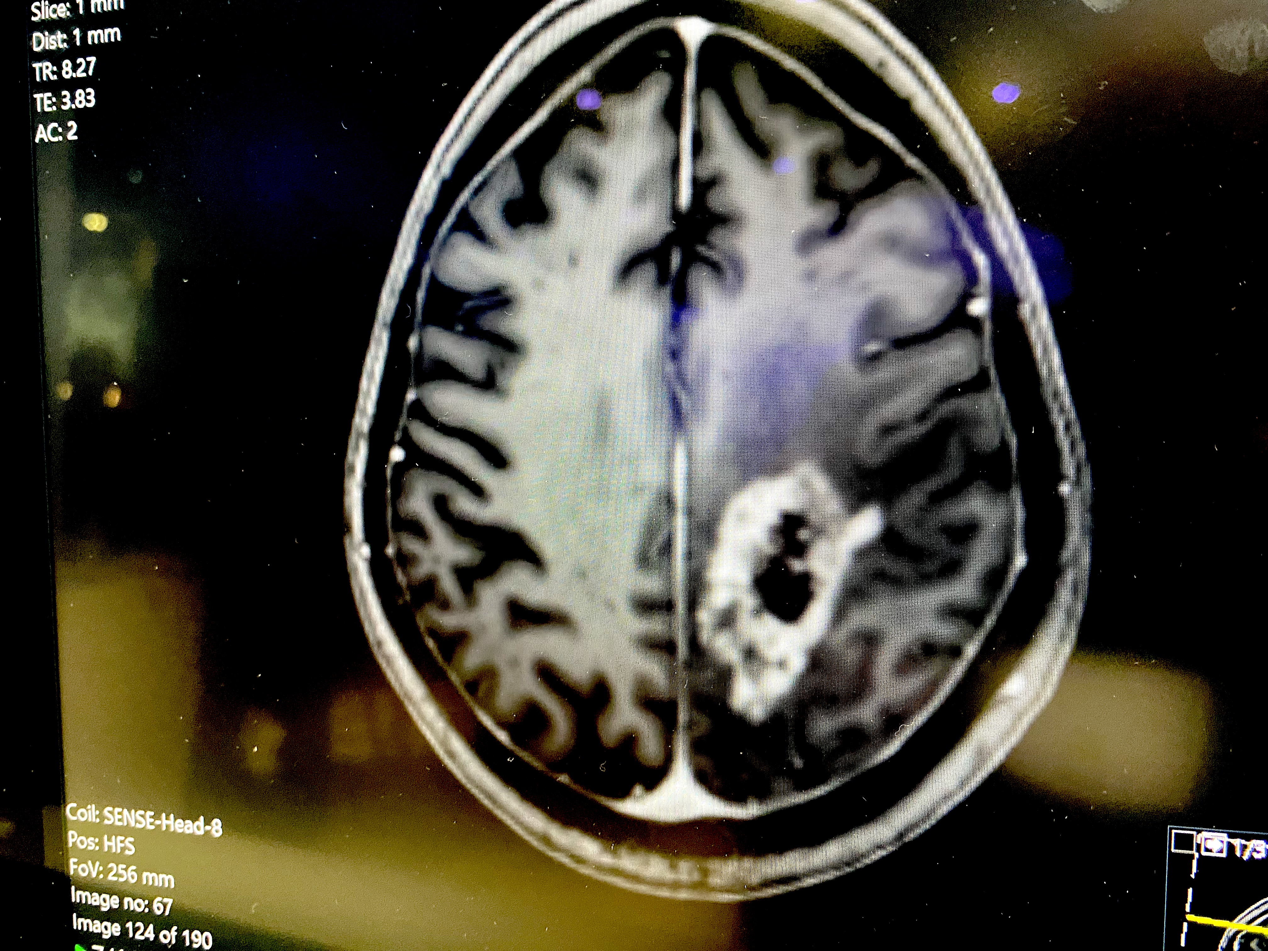 PHOTO GALLERY of brain imaging