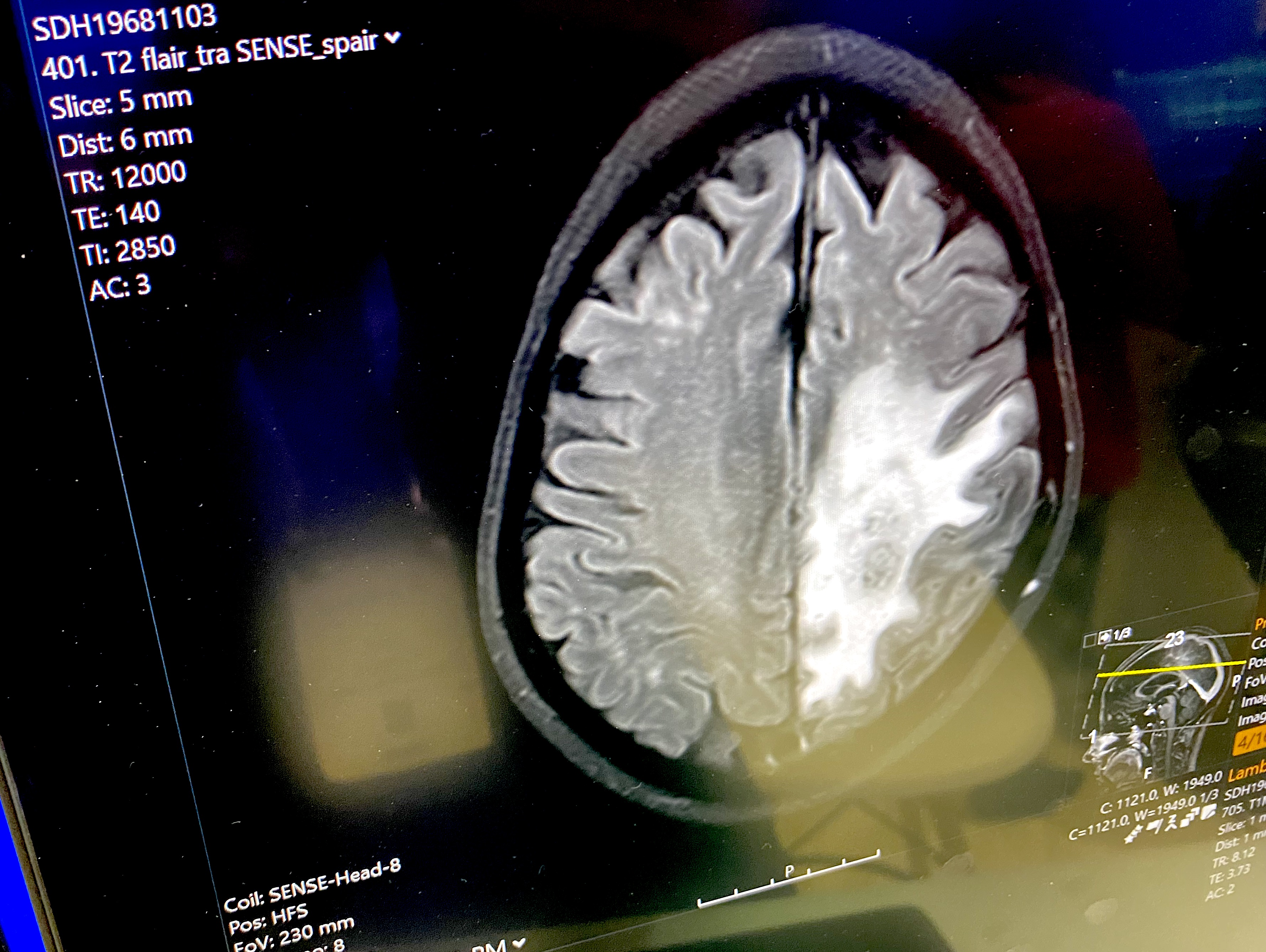 PHOTO GALLERY of brain imaging