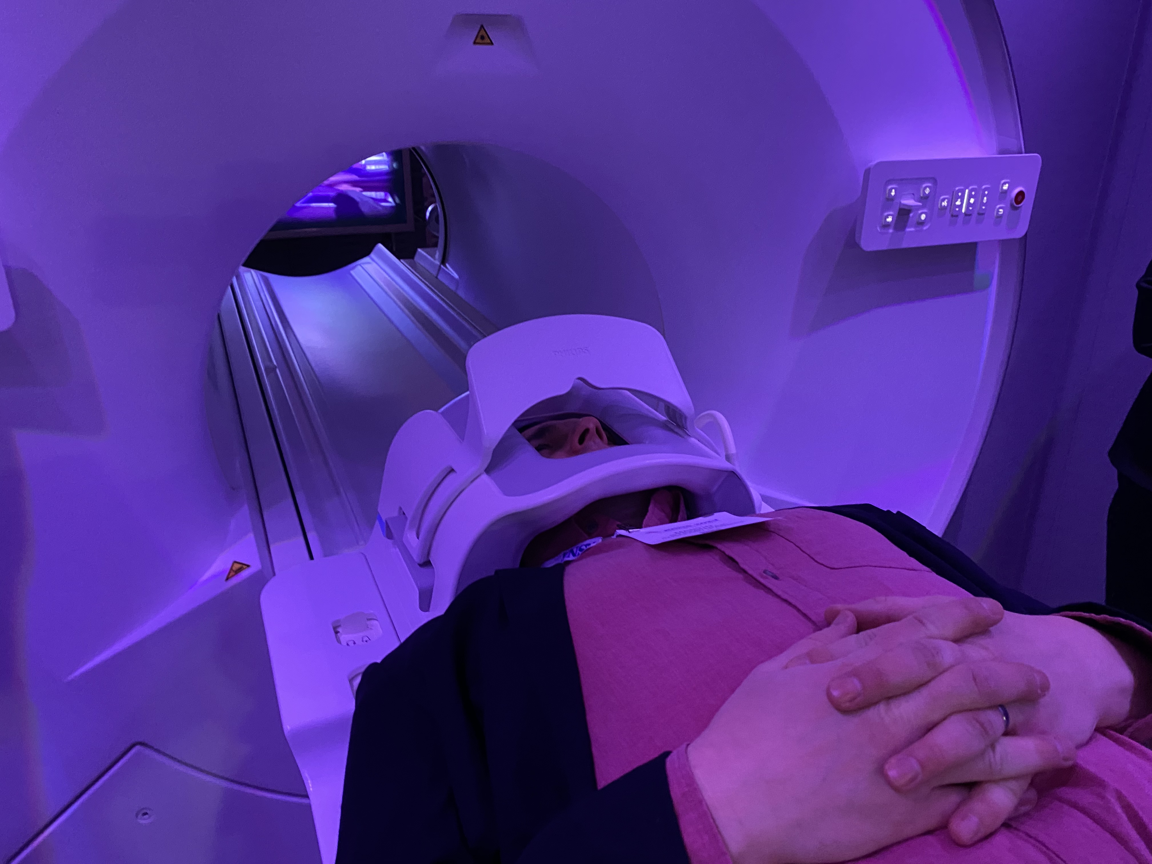 PHOTO GALLERY of brain imaging