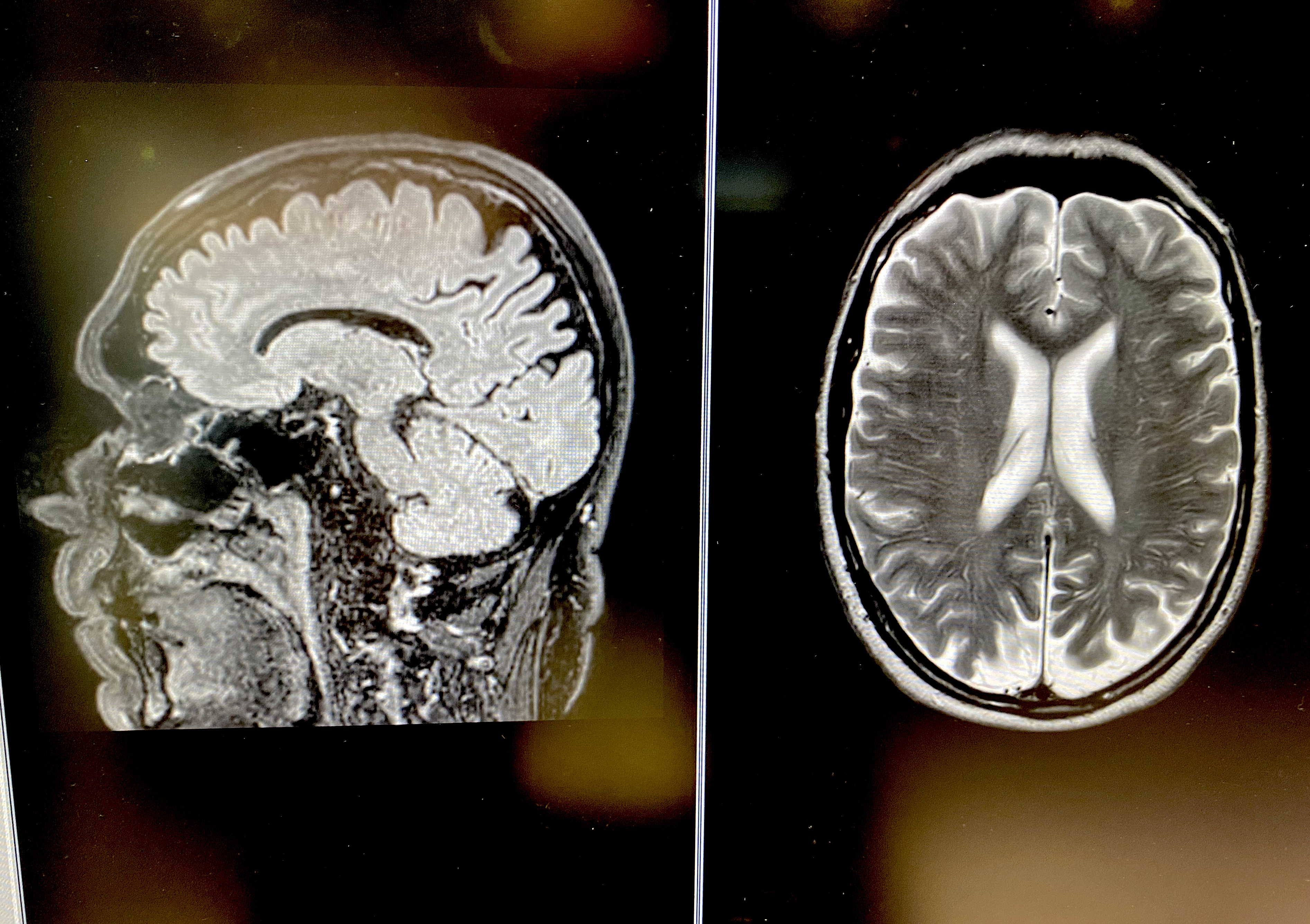 PHOTO GALLERY of brain imaging