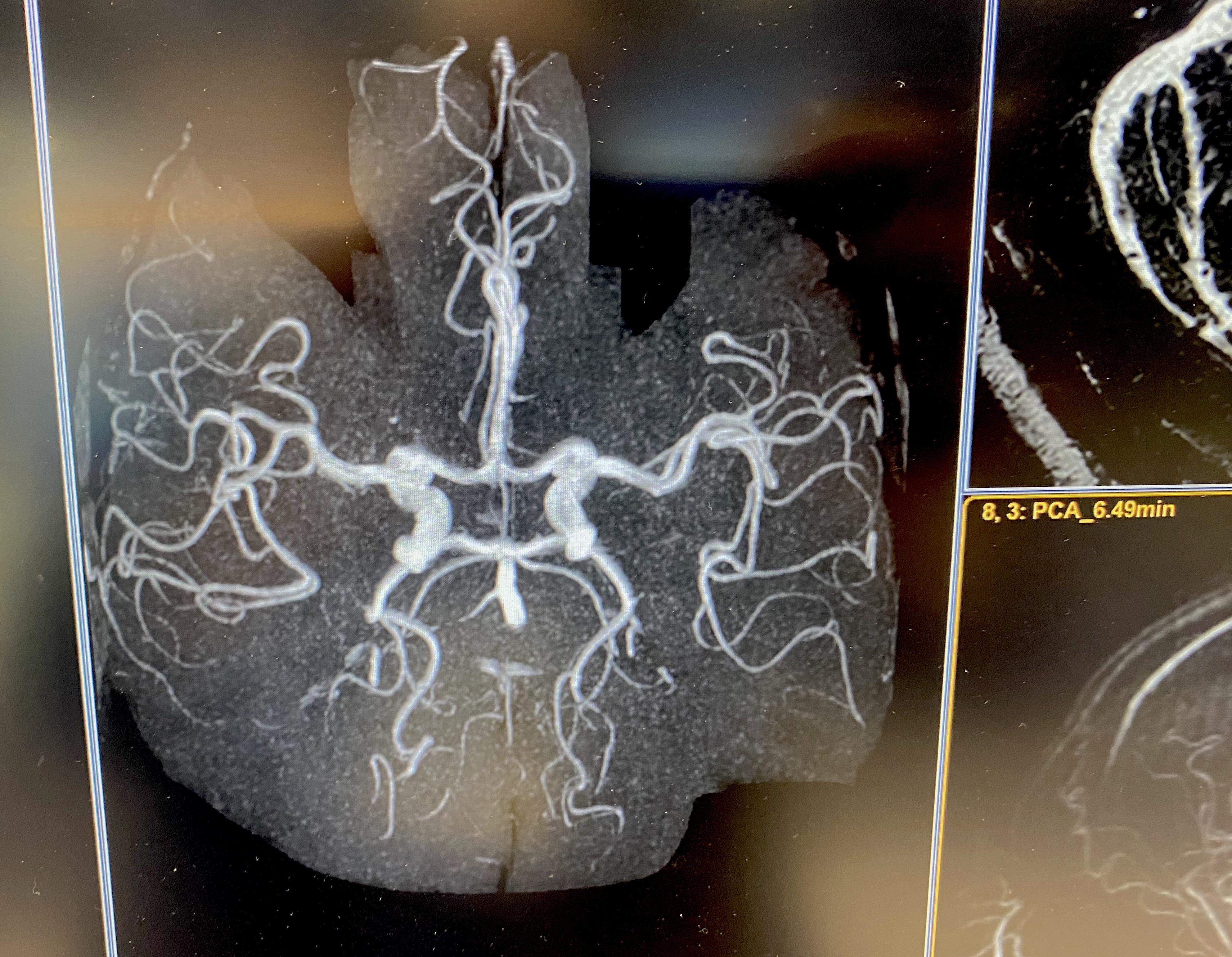 PHOTO GALLERY of brain imaging