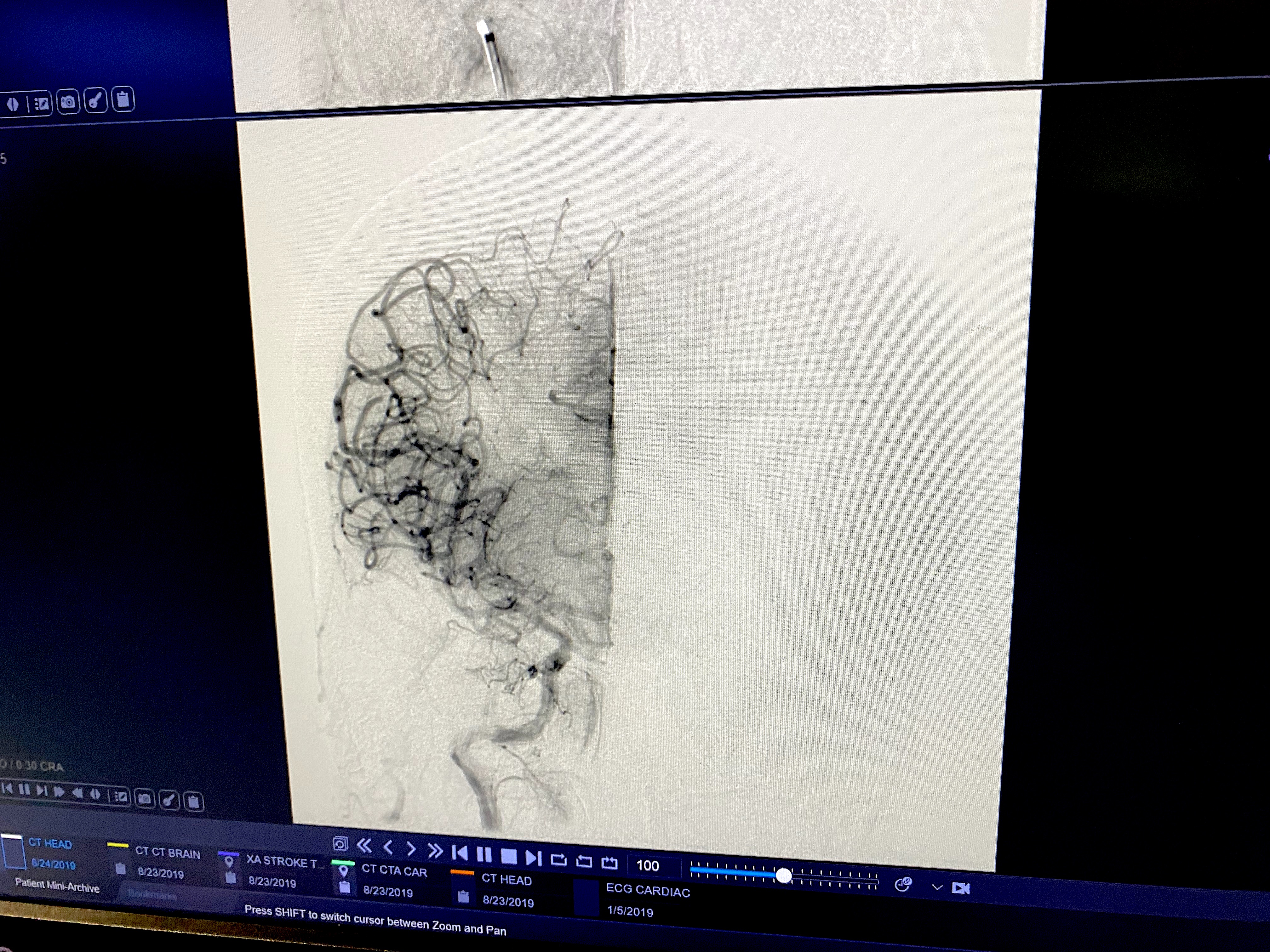 PHOTO GALLERY of brain imaging