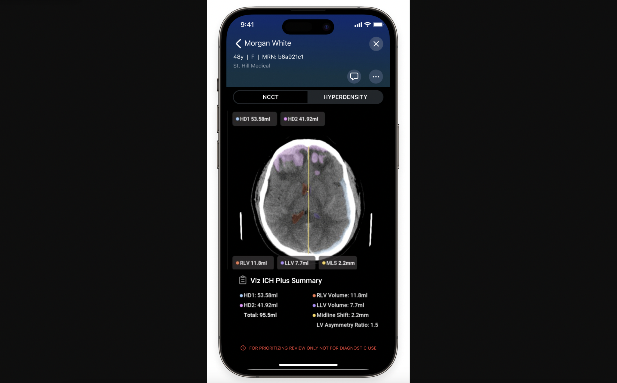 PHOTO GALLERY: Examples of FDA-cleared AI in radiology