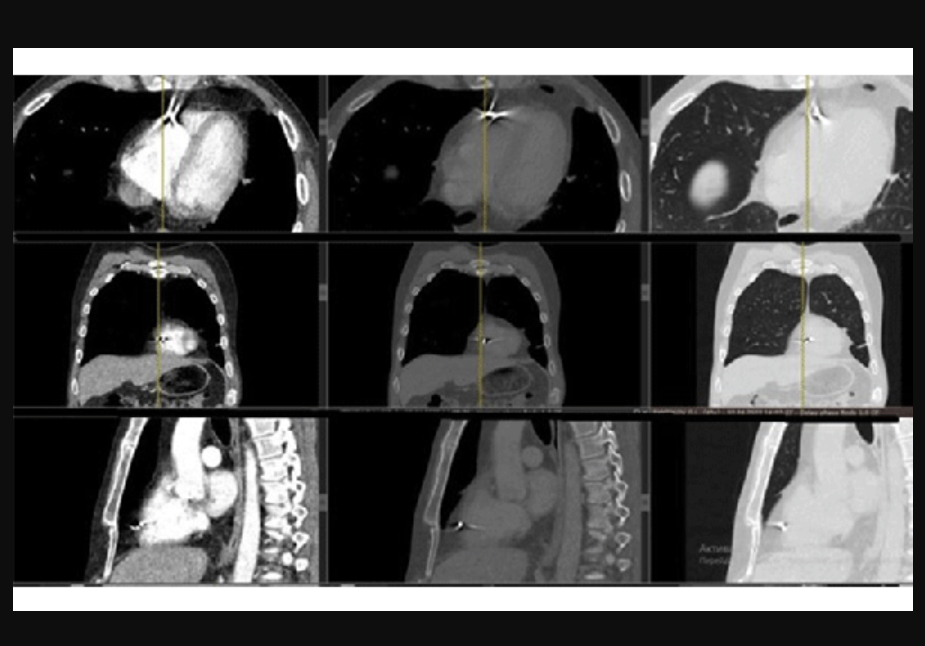 PHOTO GALLERY: Radiology images of Ukrainian trauma patients wounded in war