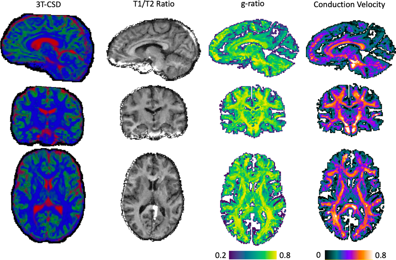 Autistic Brain Scan