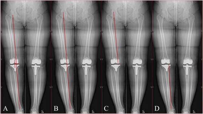 PHOTO GALLERY: Examples of FDA-cleared AI in radiology