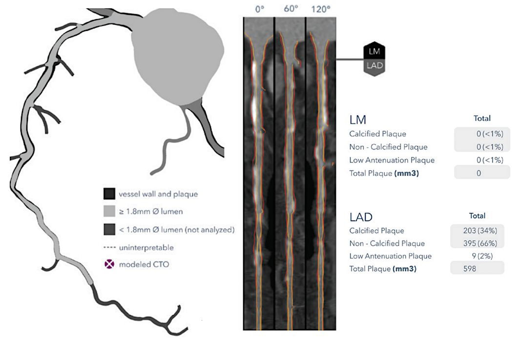 PHOTO GALLERY: Examples of FDA-cleared AI in radiology