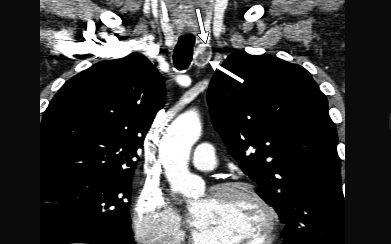 PHOTO GALLERY: What do thyroid nodules look like on imaging
