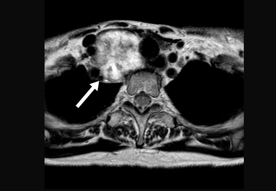 PHOTO GALLERY: What do thyroid nodules look like on imaging