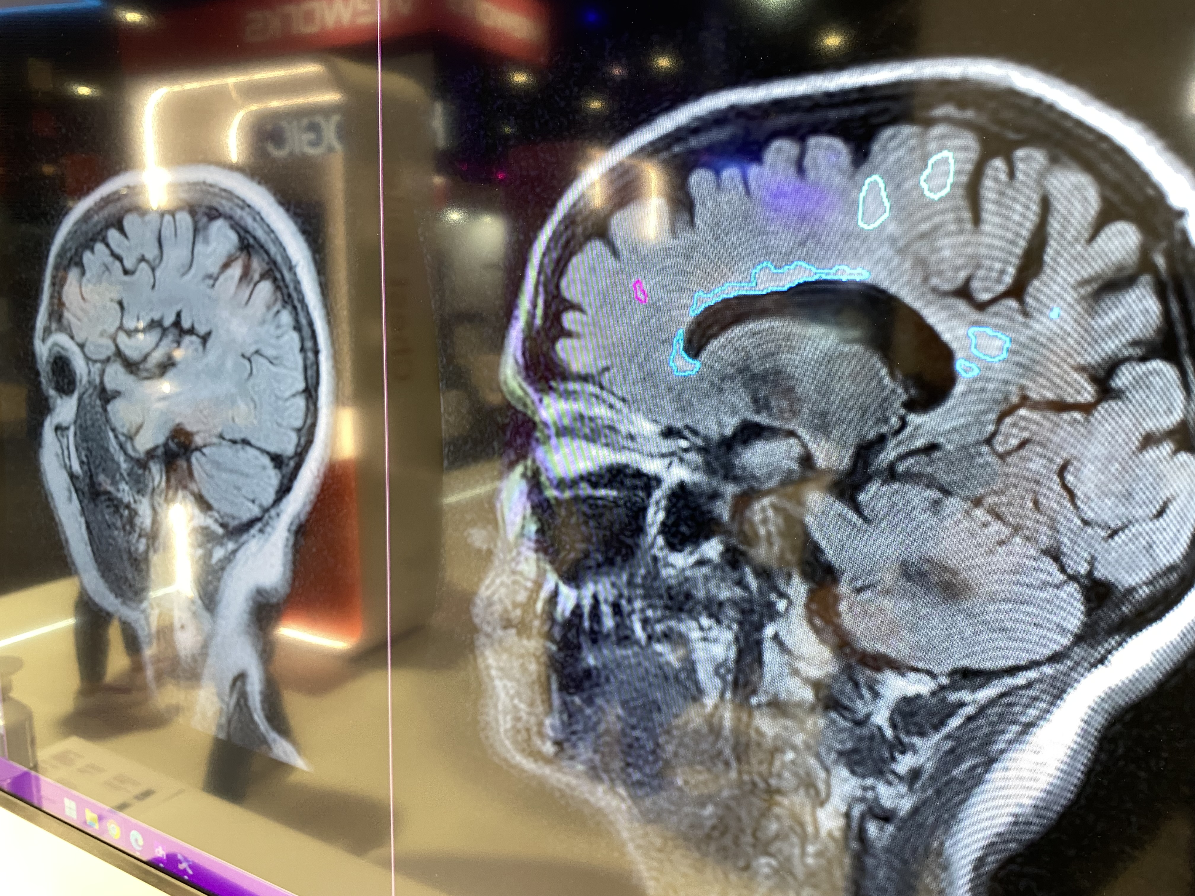 PHOTO GALLERY: Radiology technologies at RSNA 2025