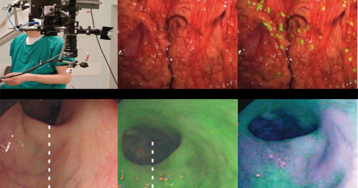 WMIS reveals new intraoperative imaging research