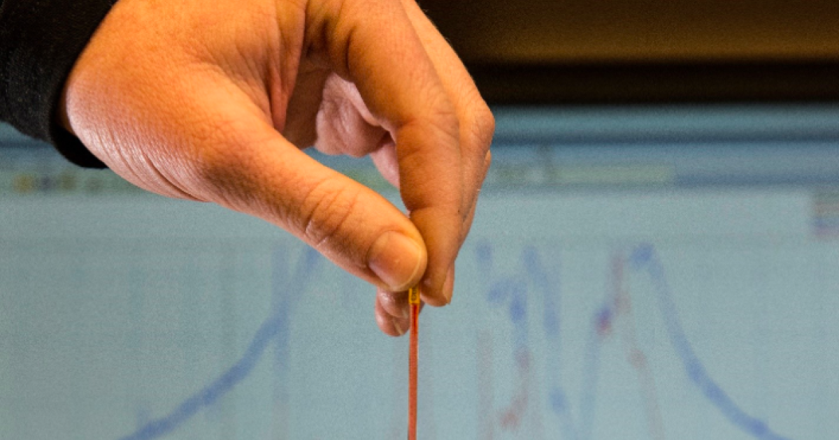 NIST paving the way for traceable measurements in the human body via MRI